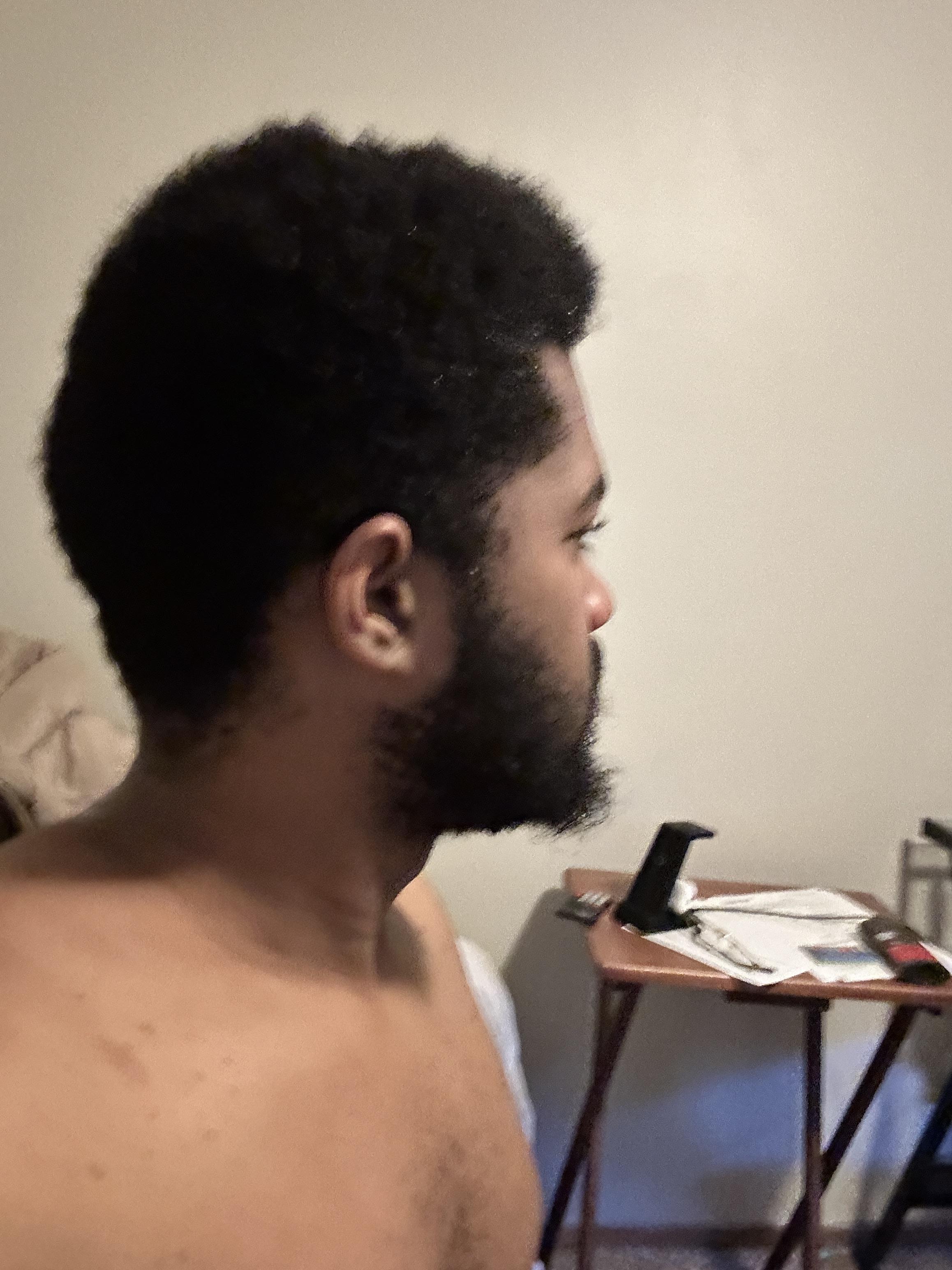 How can I fix my hair loss | Scrolller