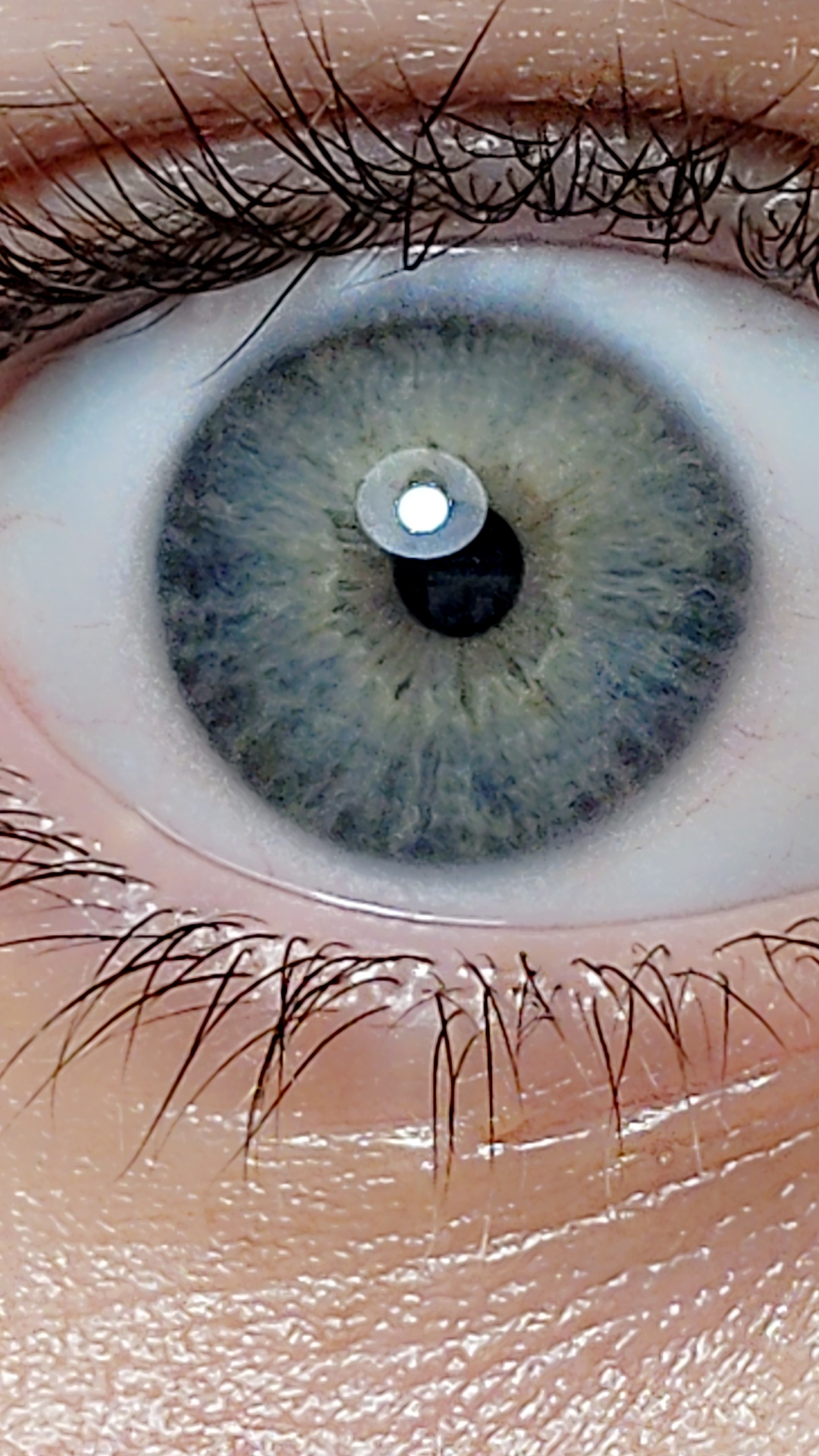 Is this centralized heterochromia? | Scrolller