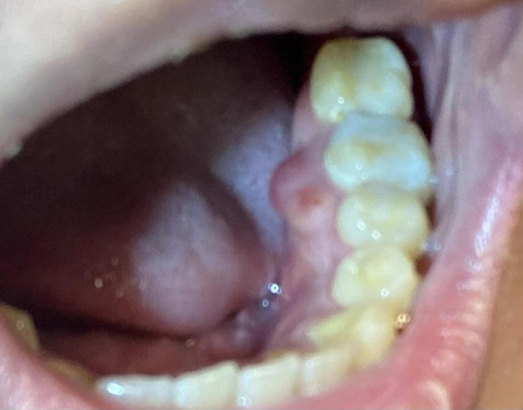 What are these bumps? | Scrolller