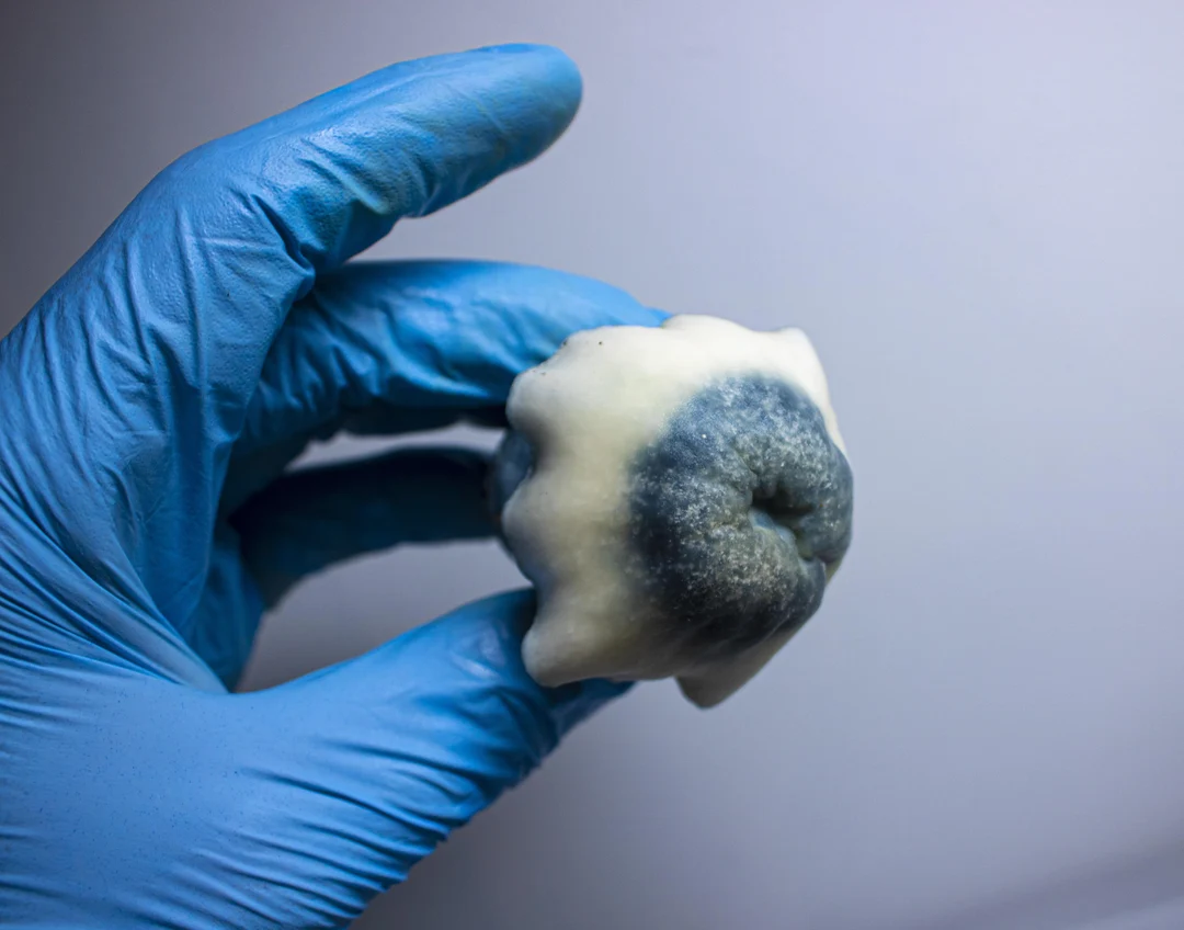 psilocybe cubensis - unbleached anus. | Scrolller