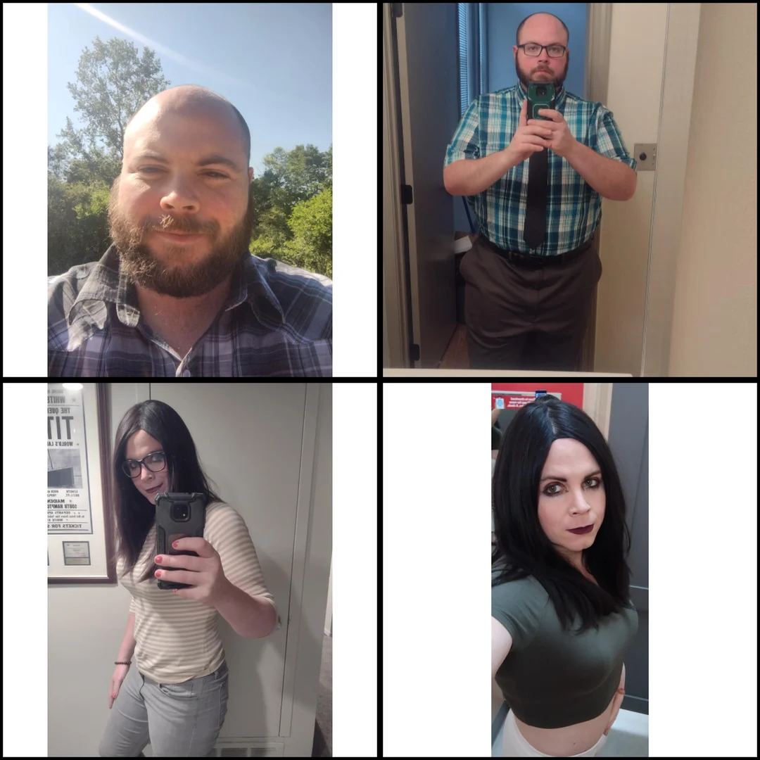 I still find it hard to reconcile this is the same person | Scrolller