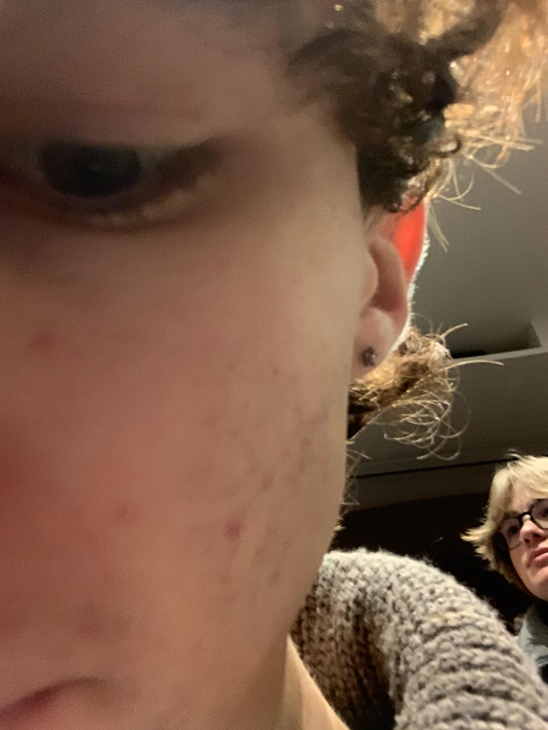 Discover more like Trans: Stubble after 1st session of laser? and Related Content | Scrolller