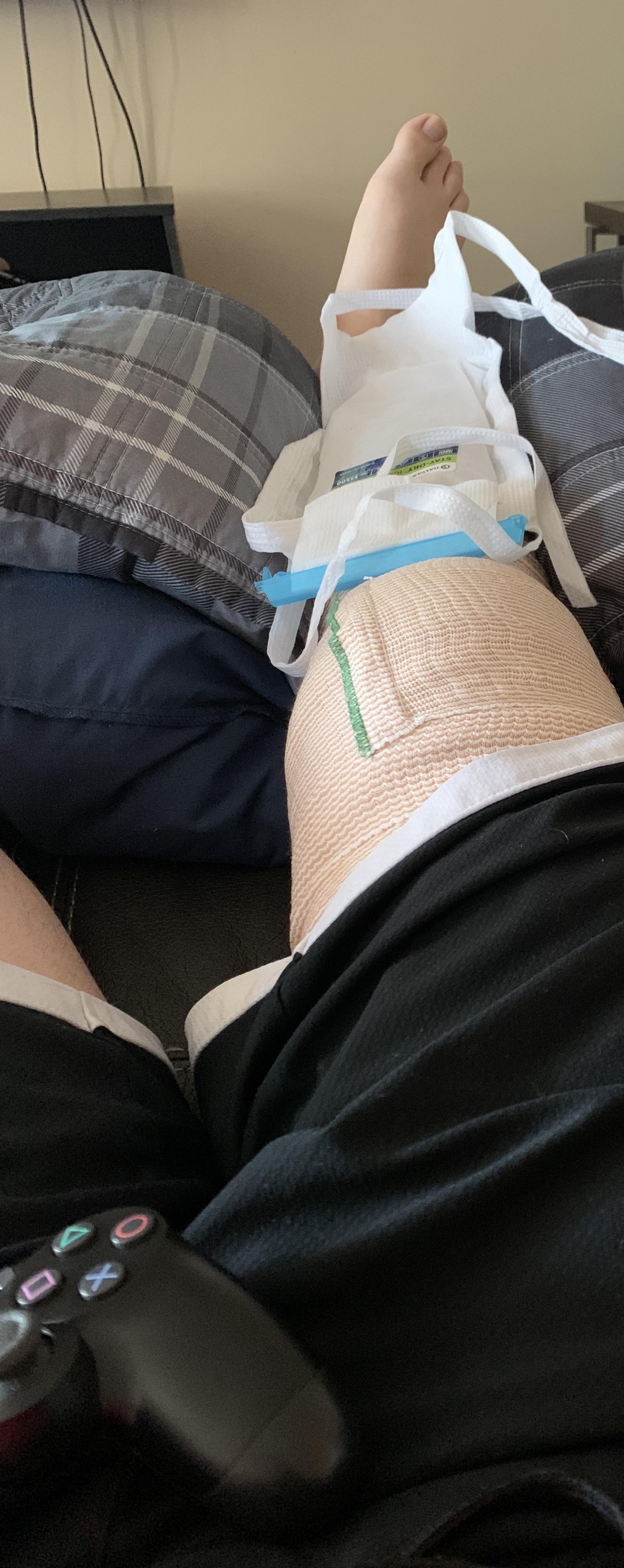 Took an arrow to the knee | Scrolller