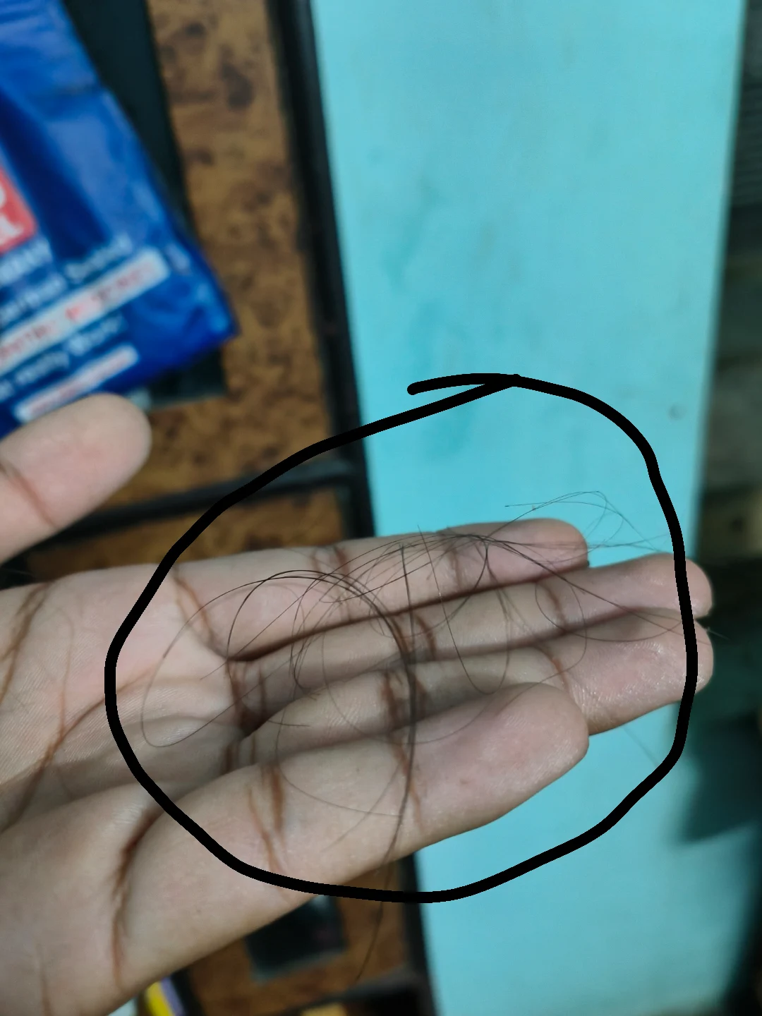 Having hairfall problem | Scrolller