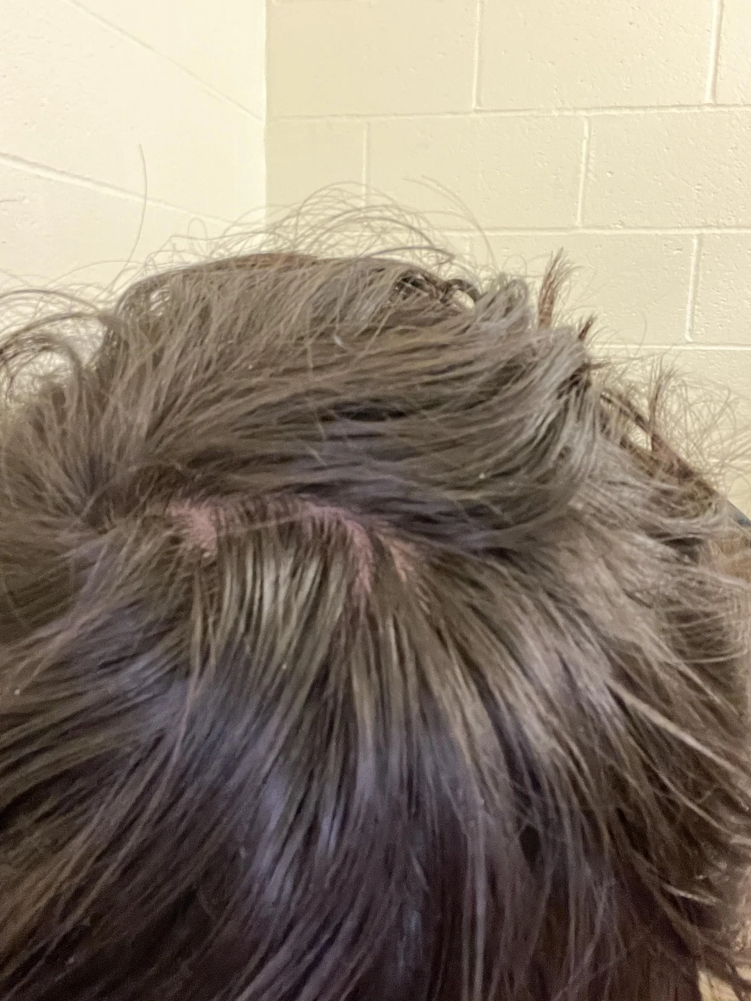 Early stages of balding (17m) | Scrolller