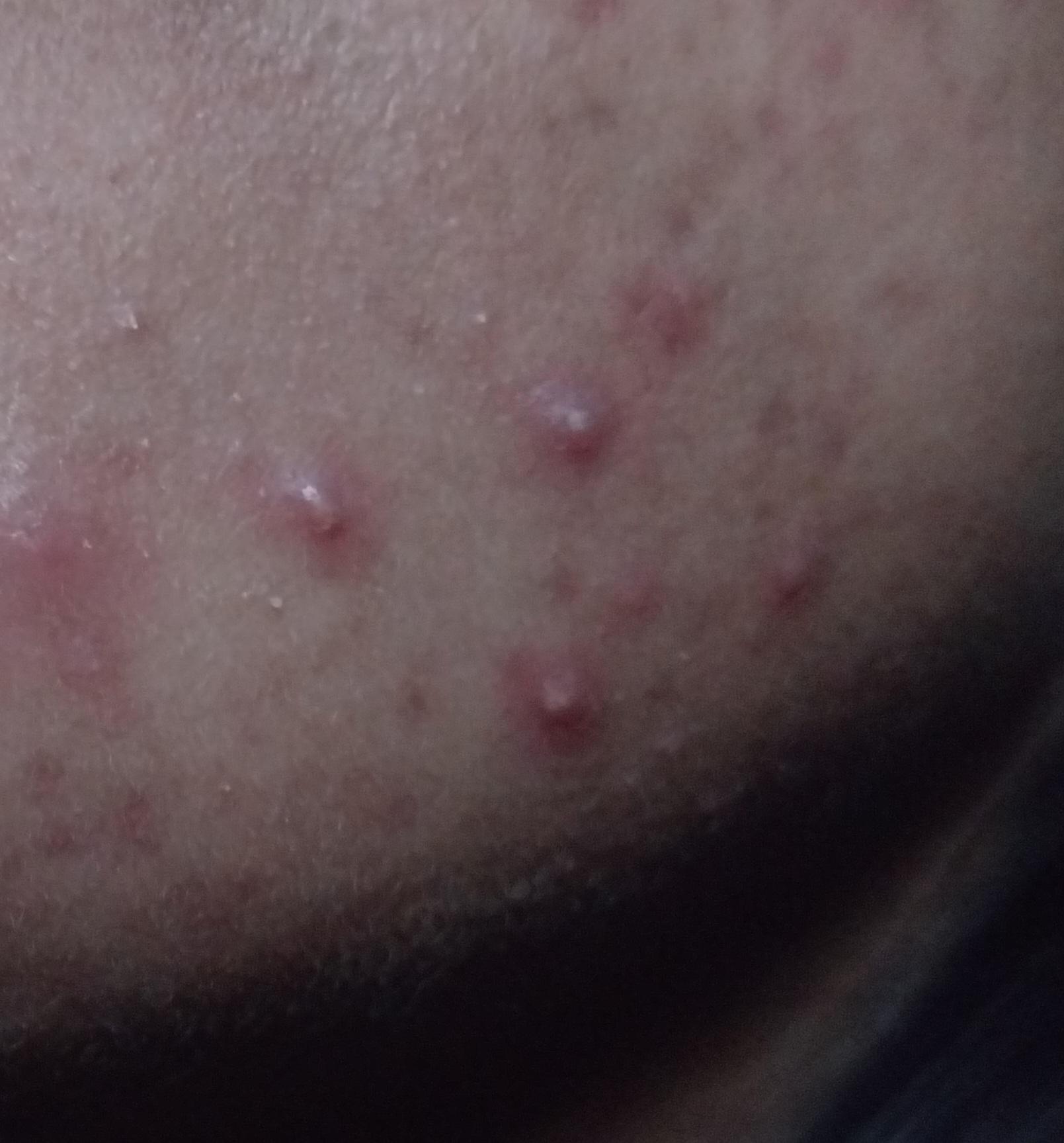 Help what is this called | Scrolller