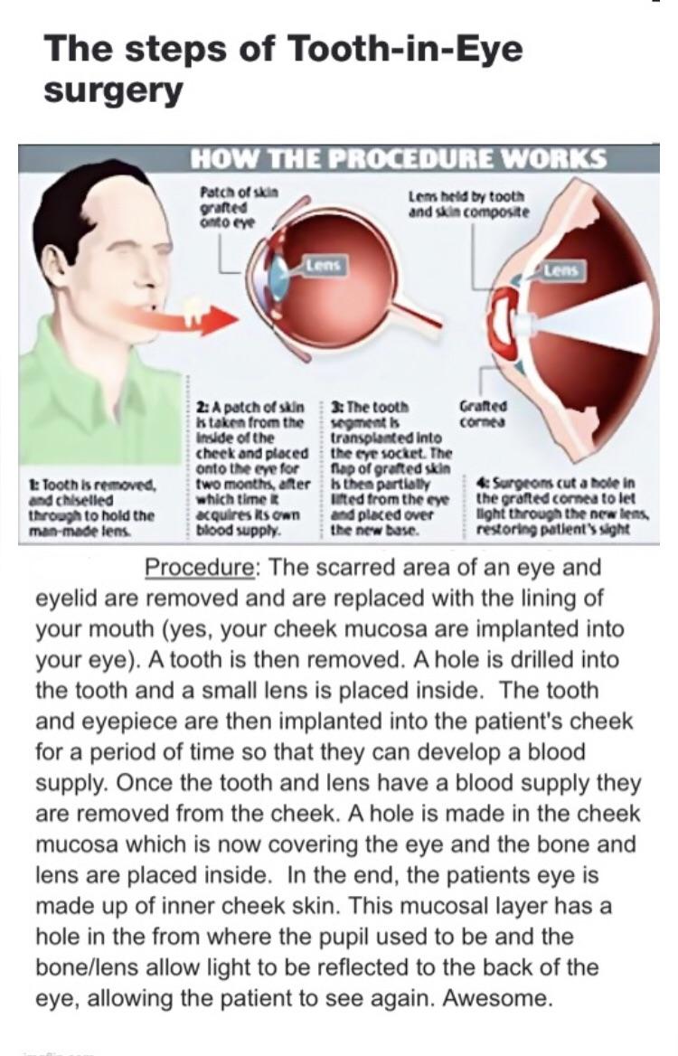 Eye for a Tooth? | Scrolller