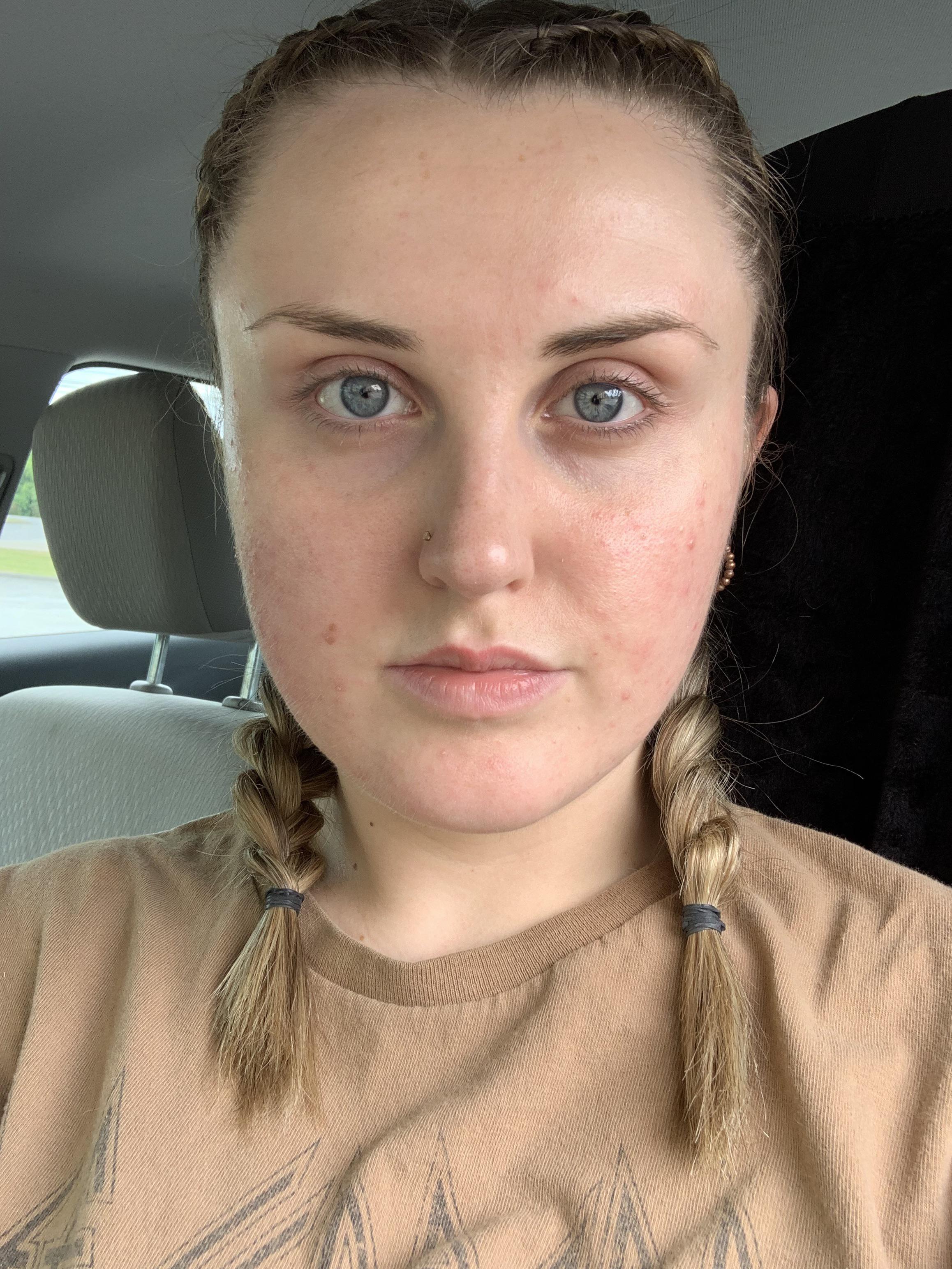 Opinions | Scrolller