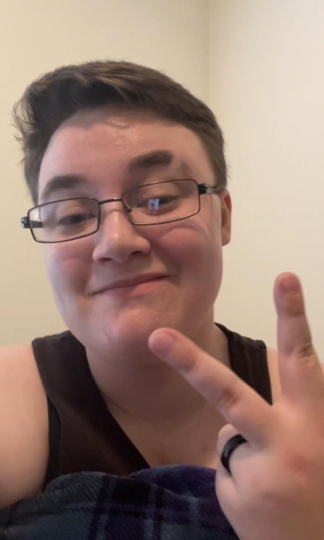 Almost 2 years on T yo! | Scrolller