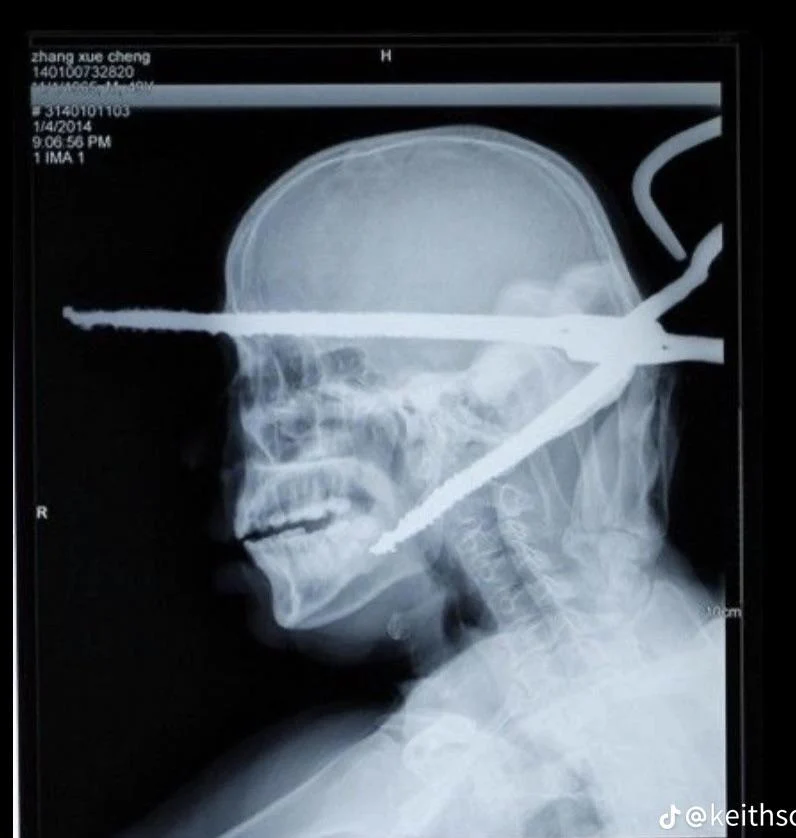 nahh just a scratch | Scrolller