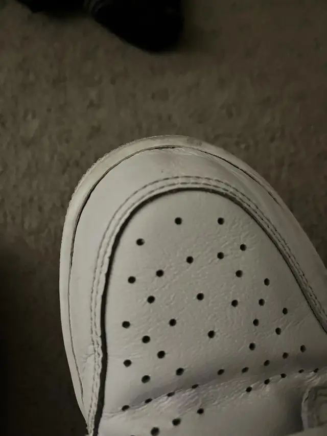 Can I fix this? Will it get worse? | Scrolller