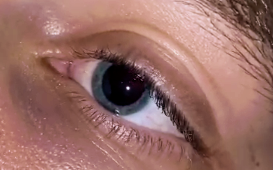 My eyes on MDMA | Scrolller