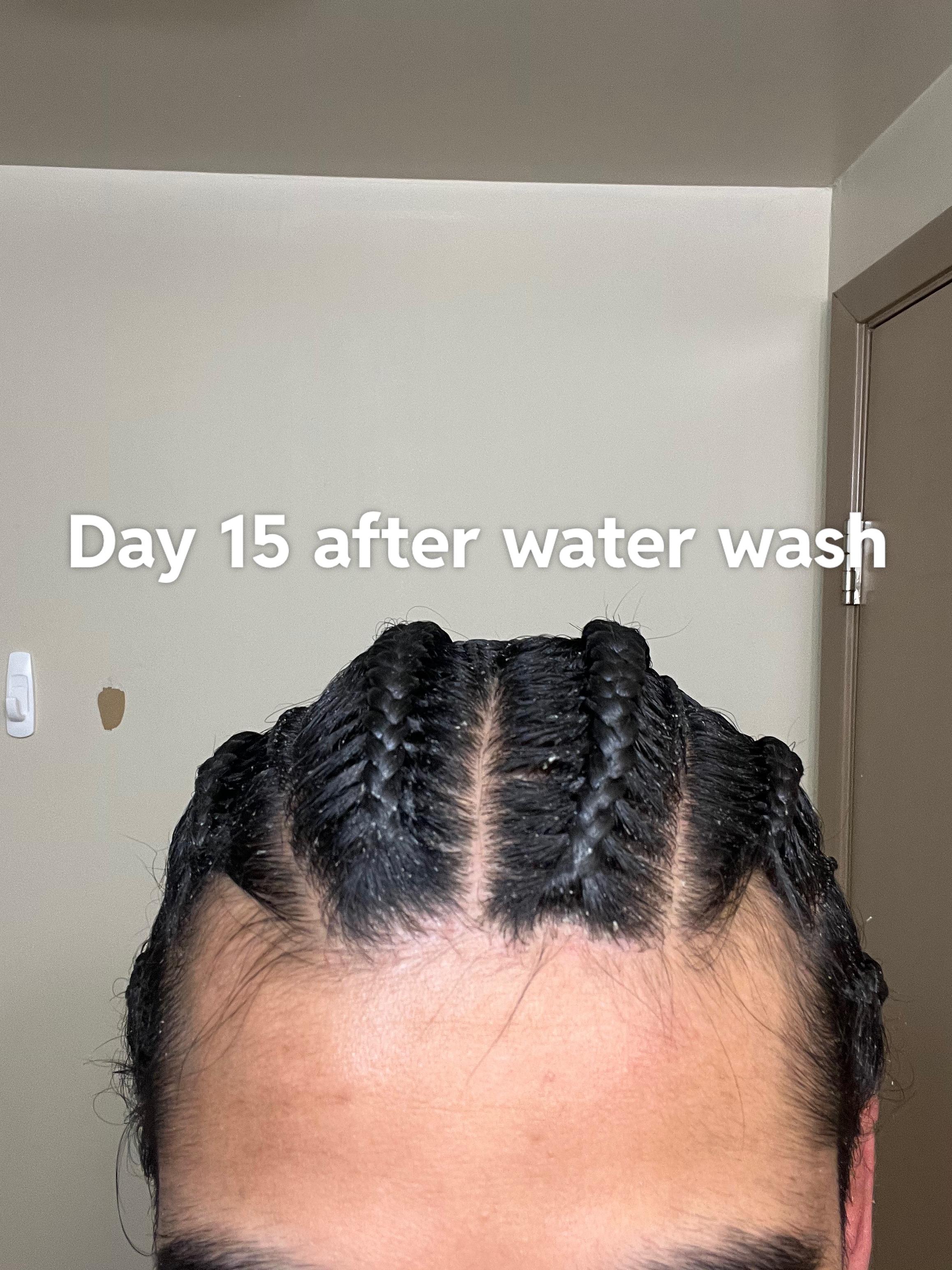 How to get rid of the build up and stop itching. | Scrolller