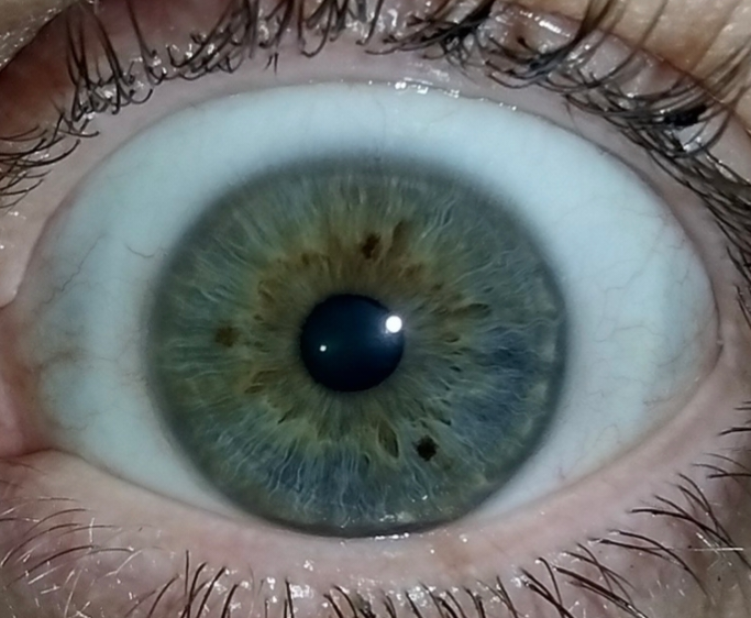 Central Heterochromia? Hazel? Green? | Scrolller