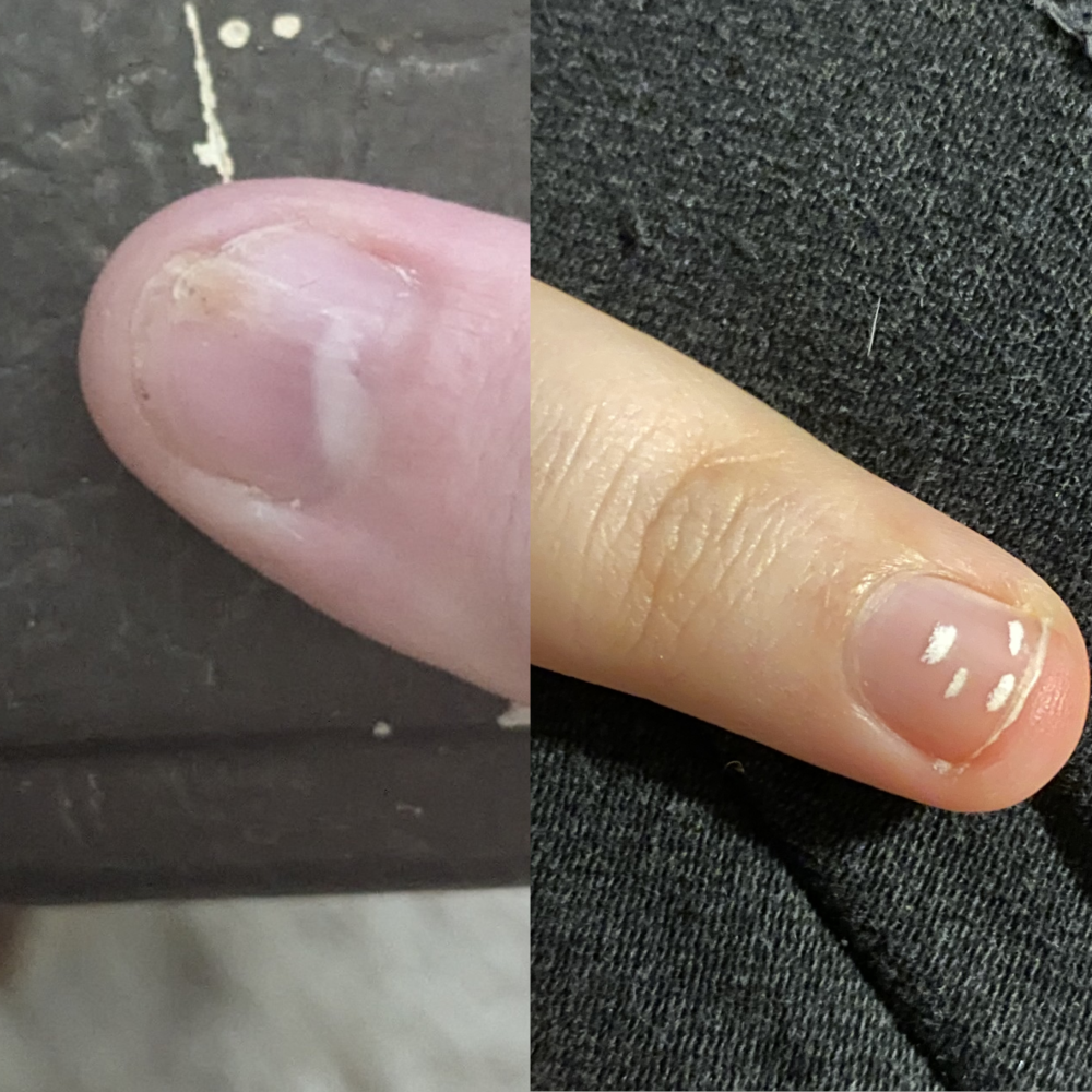 Me and my friend's nails | Scrolller