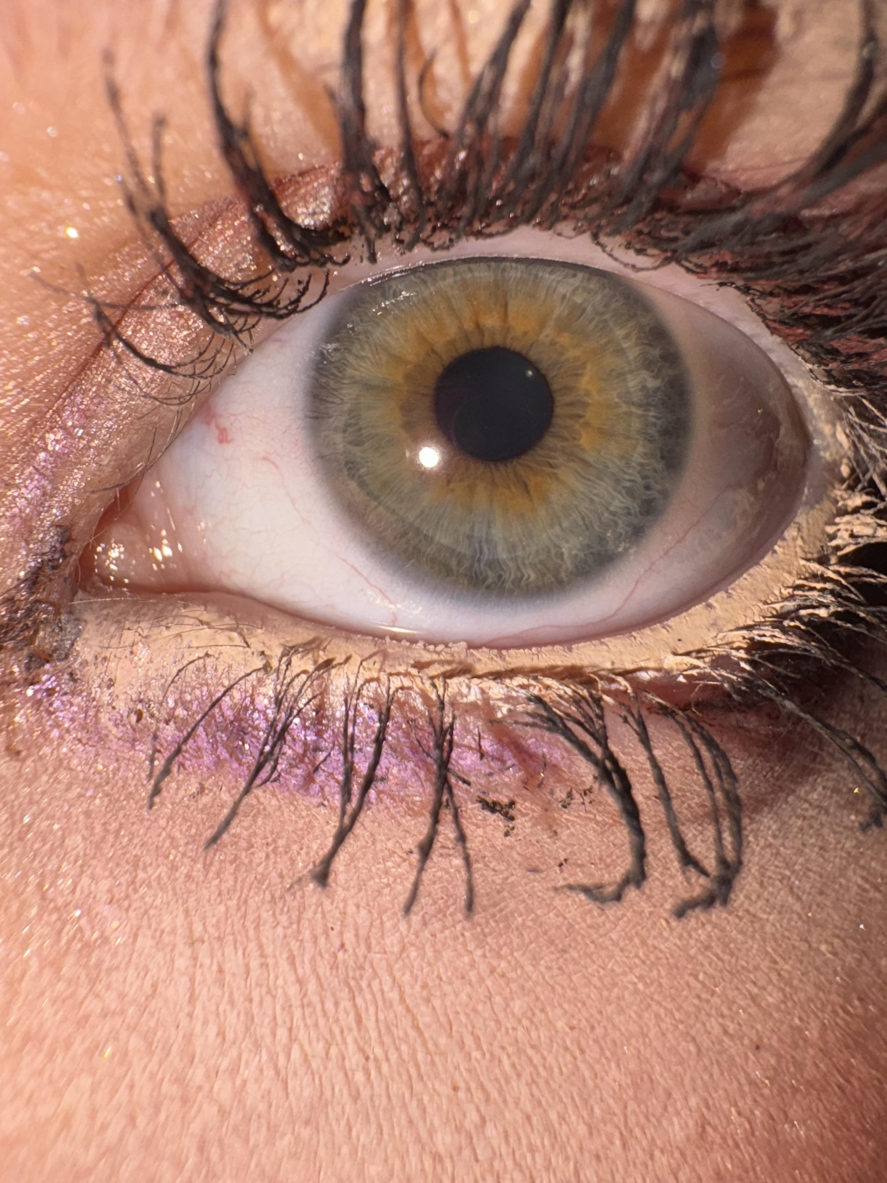 Discover more like Eyes: Finally got a macro cam and Related Content | Scrolller