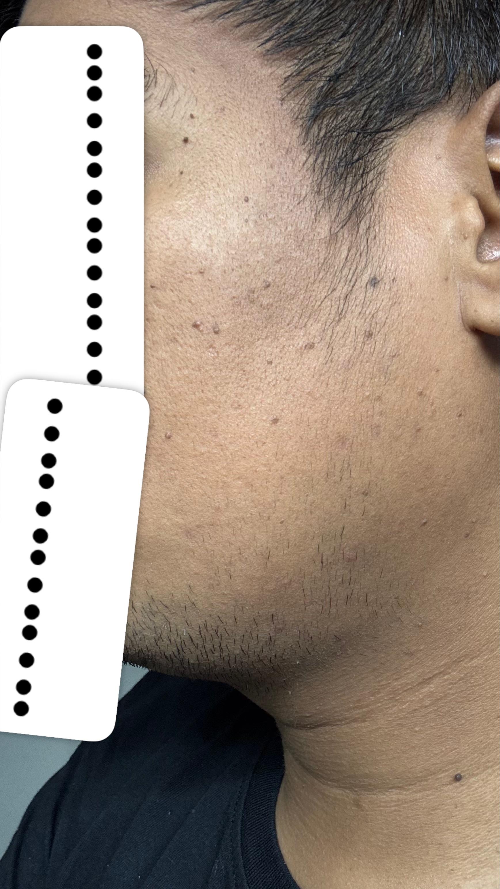 Face has all the bumps and patches of different skin tone (idk the word for that). Need general ...