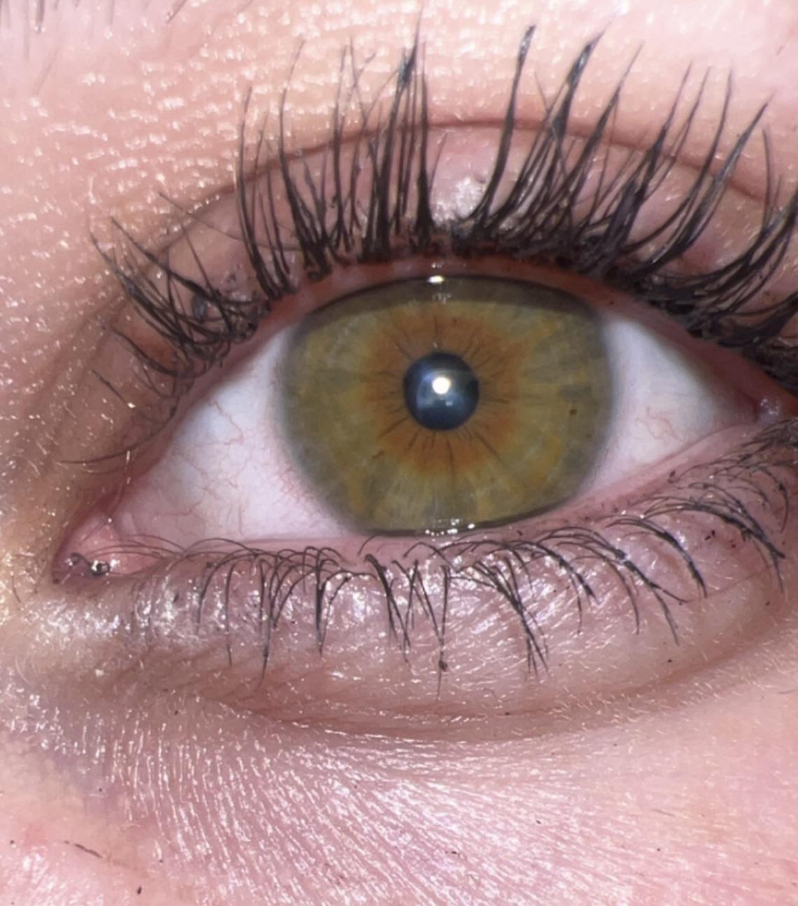 green, hazel, or central heterochromia? | Scrolller