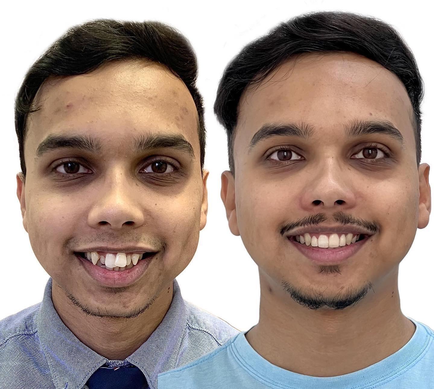 Here's my update. Life changing :) | Scrolller