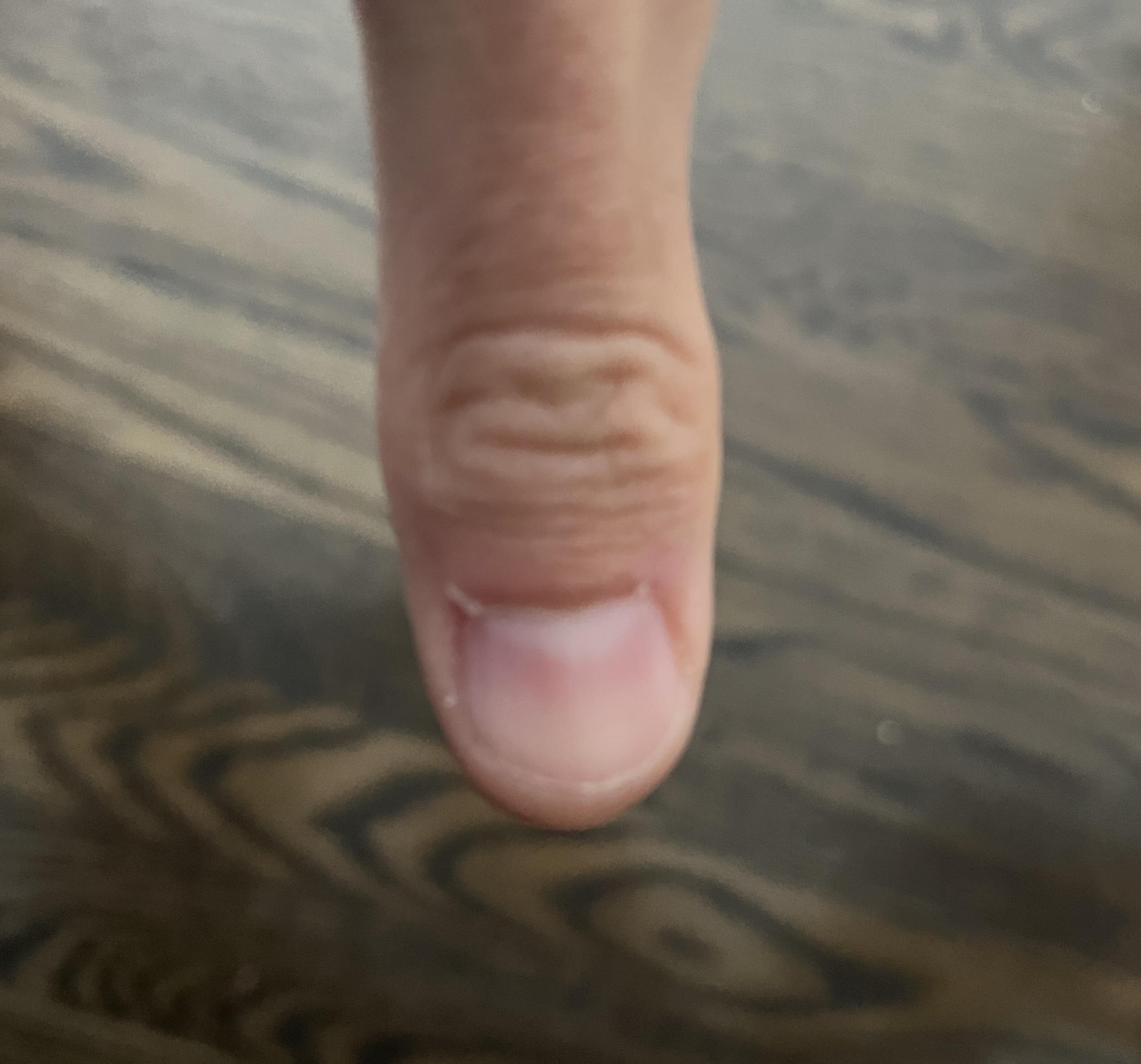 There’s a face on my knuckle | Scrolller