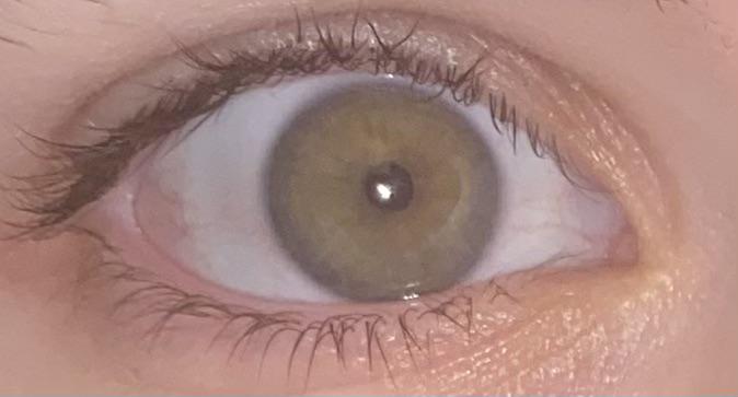 What colour are they? Green? Brown? Hazel? | Scrolller