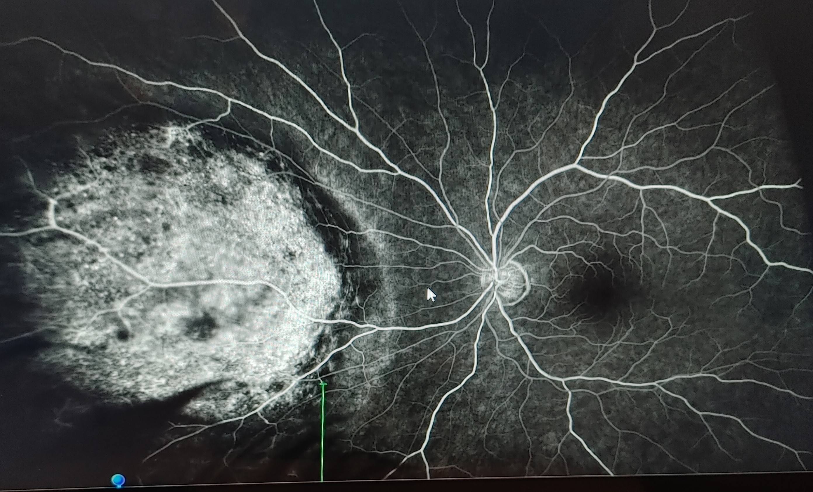 Update on stroke boy and the rando bros who caught it early | Scrolller
