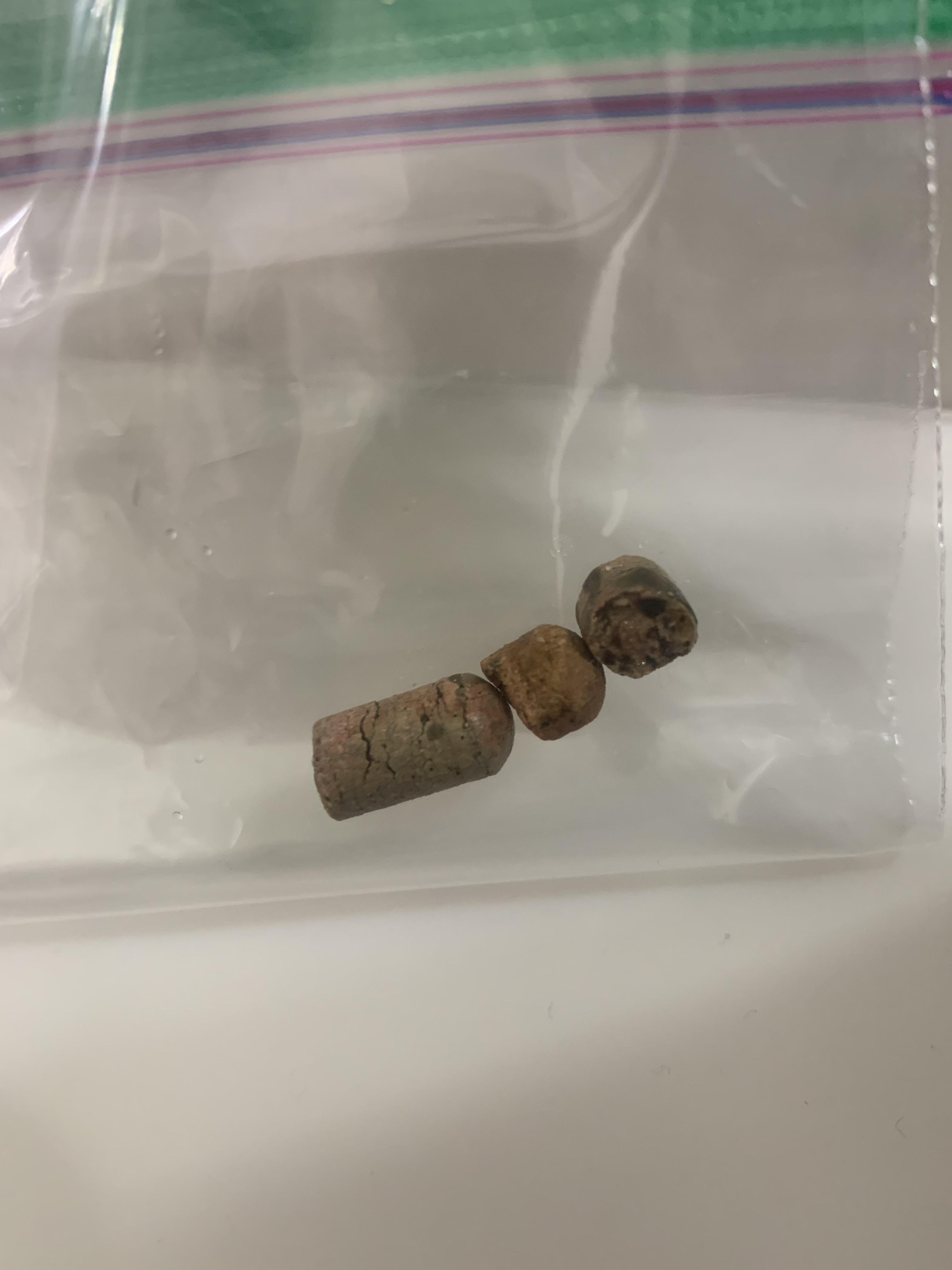 Does anyone know what these are? They were in my stool. | Scrolller