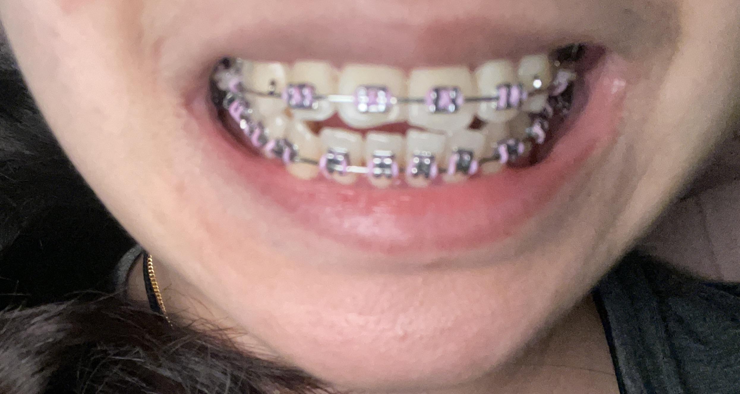 Progress after 170+ days! | Scrolller