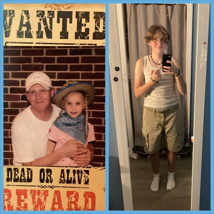 before and after trans ftm | Scrolller