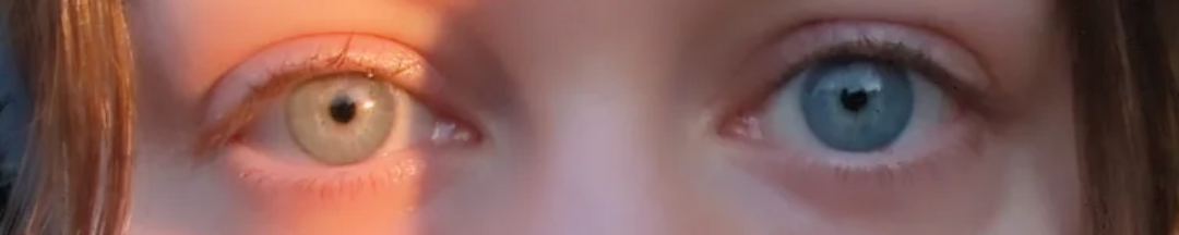 My eye color in the sun vs in the shade | Scrolller