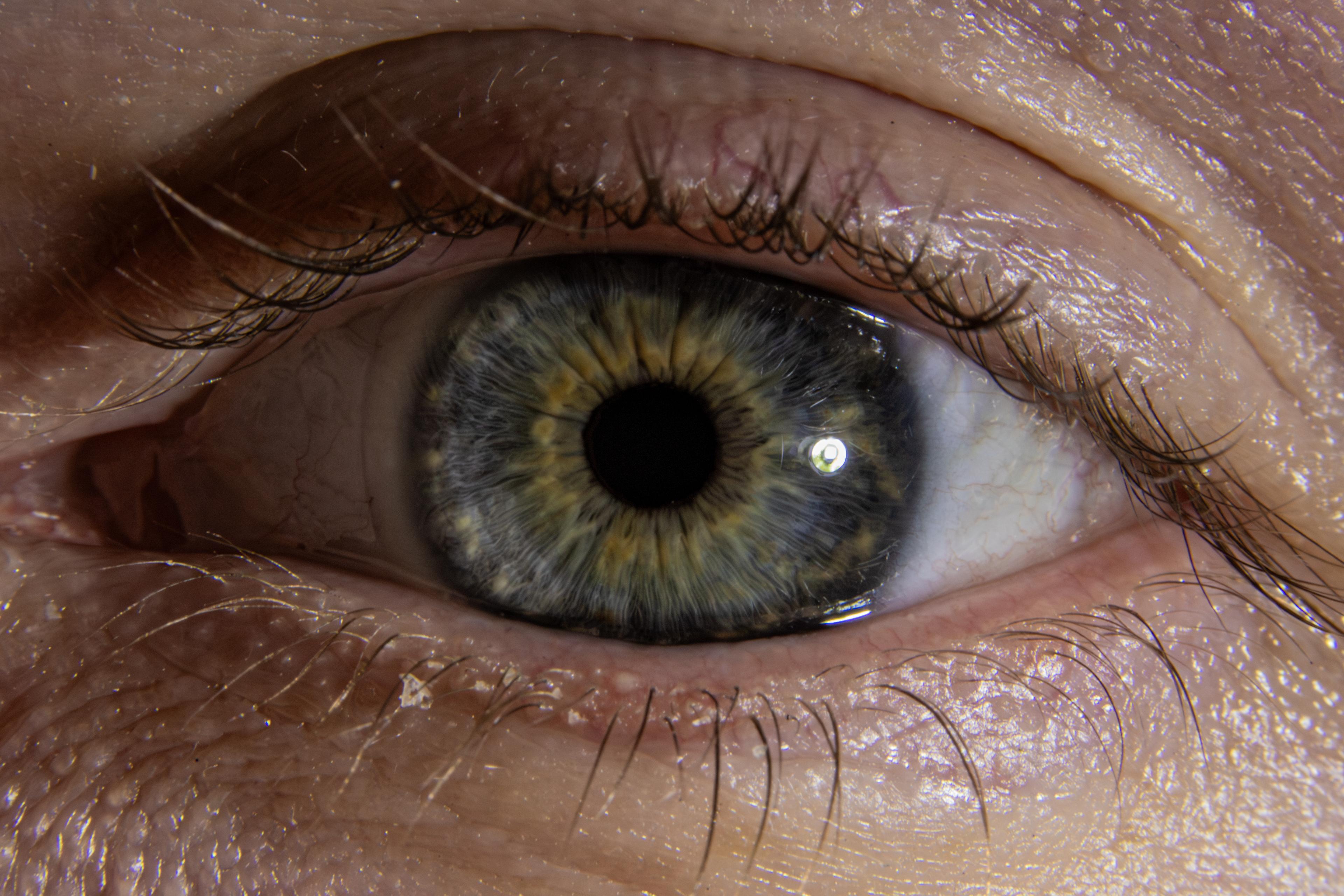 'Macro' shot. Are they gray? | Scrolller