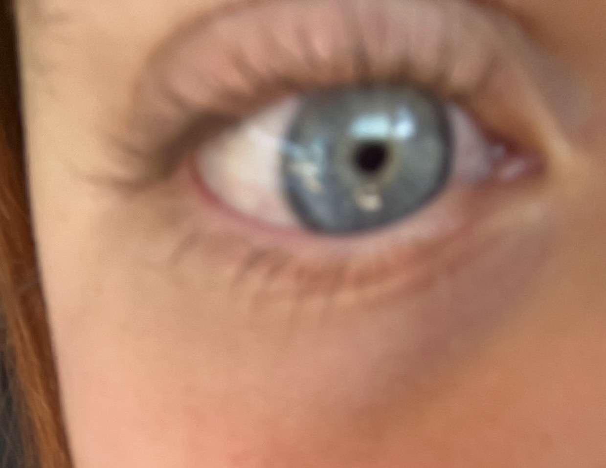 Pics of my eye | Scrolller