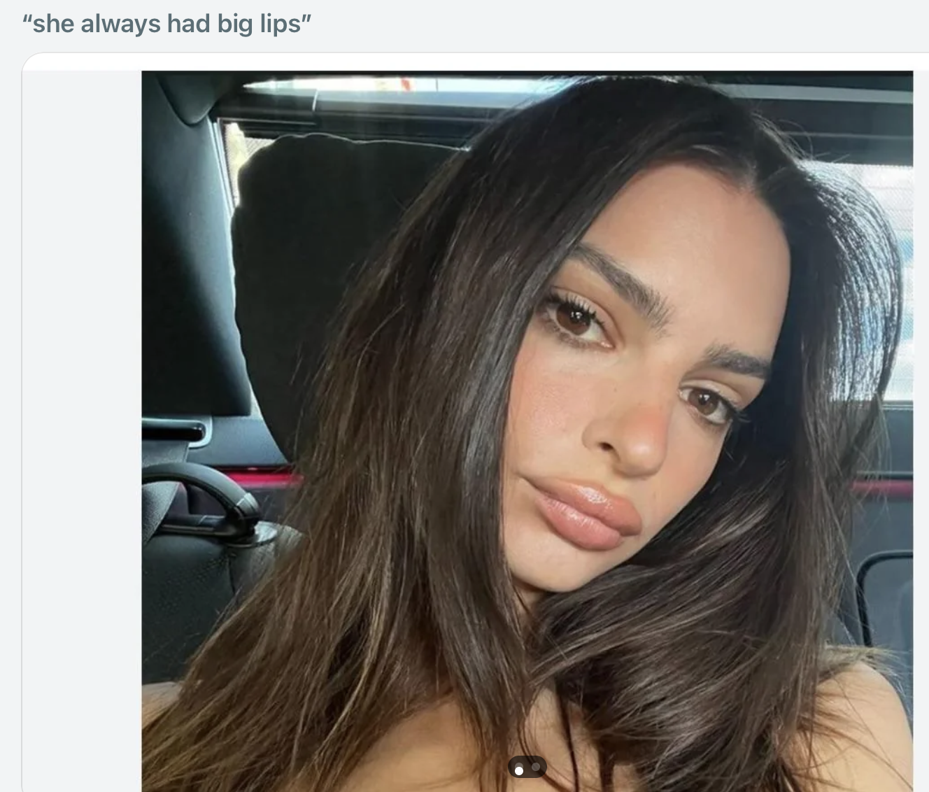 Lip filler denial is insane | Scrolller