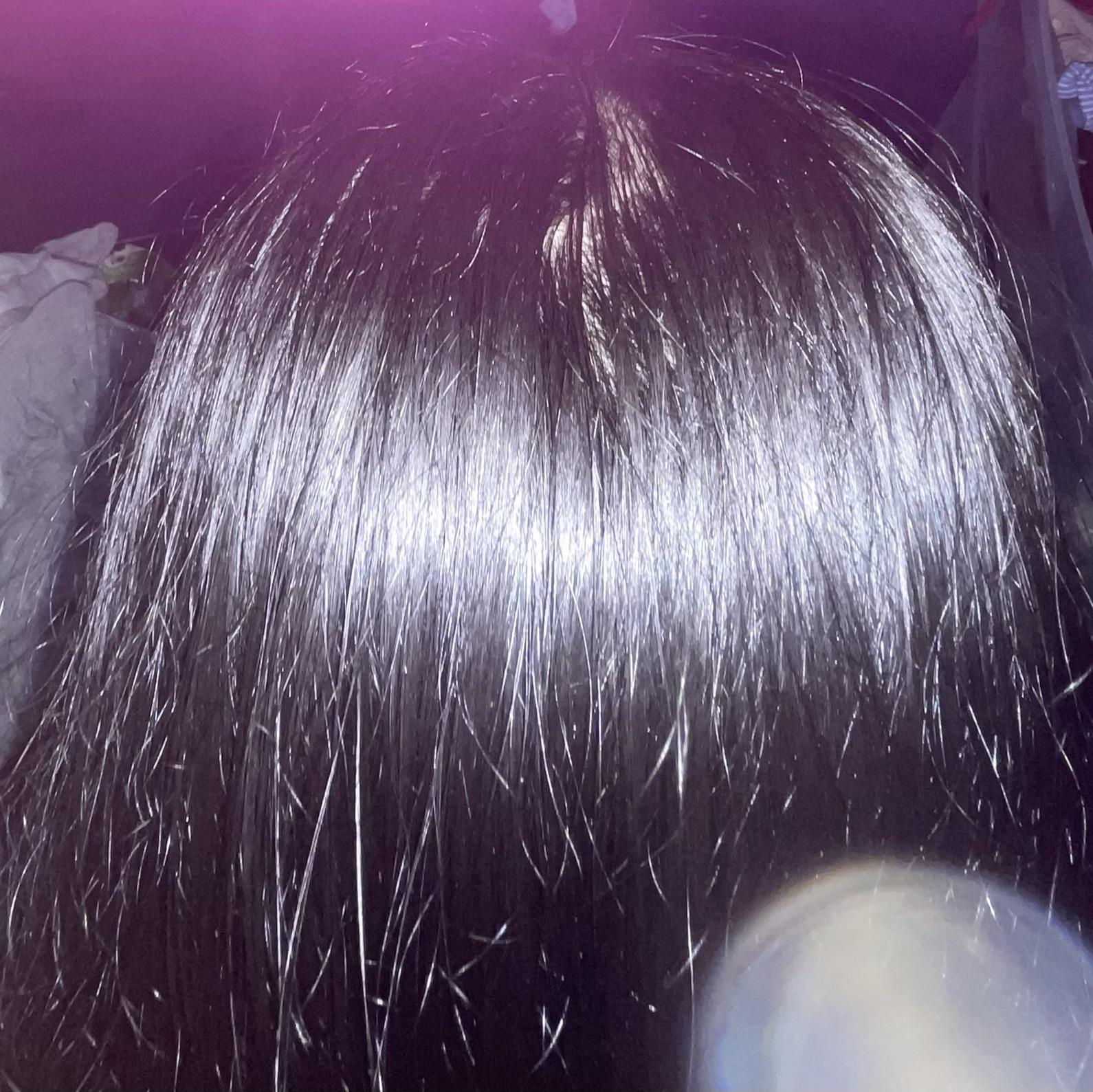 Is this normal? | Scrolller