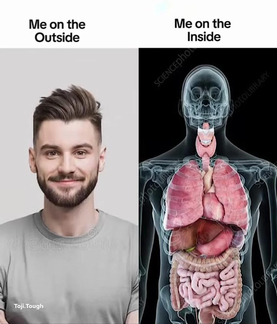 Me on the inside | Scrolller