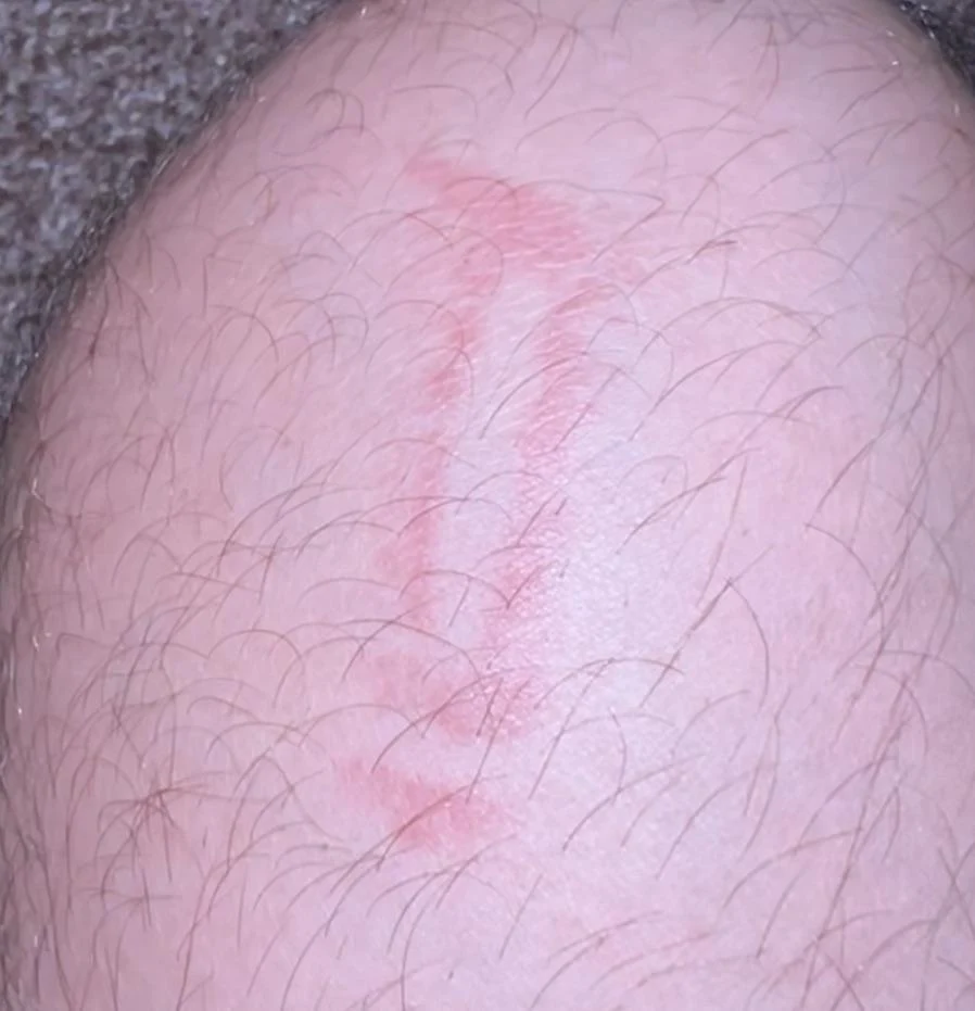 ️mind your hot muzzle | Scrolller