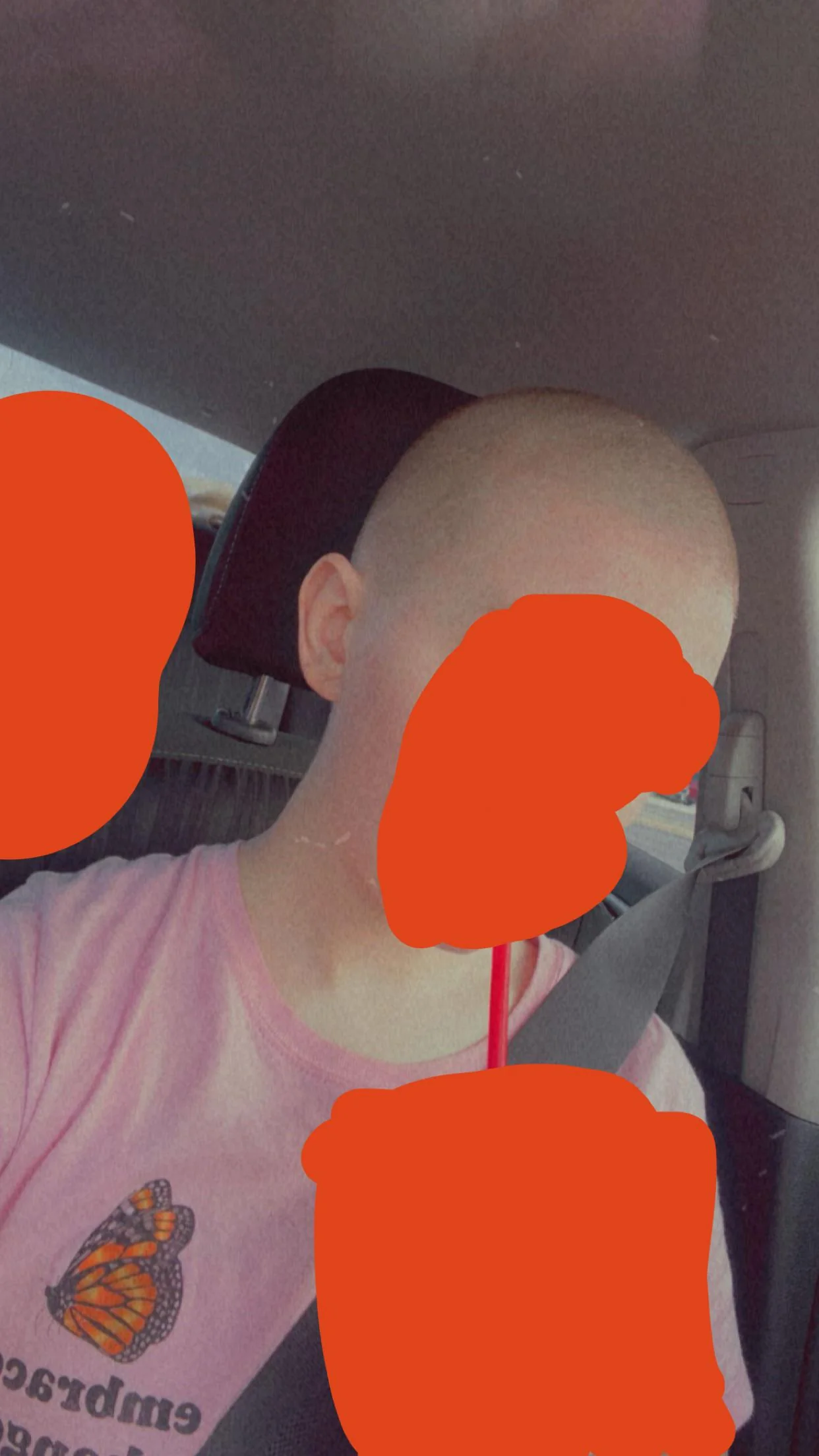 She was bald Jerry | Scrolller