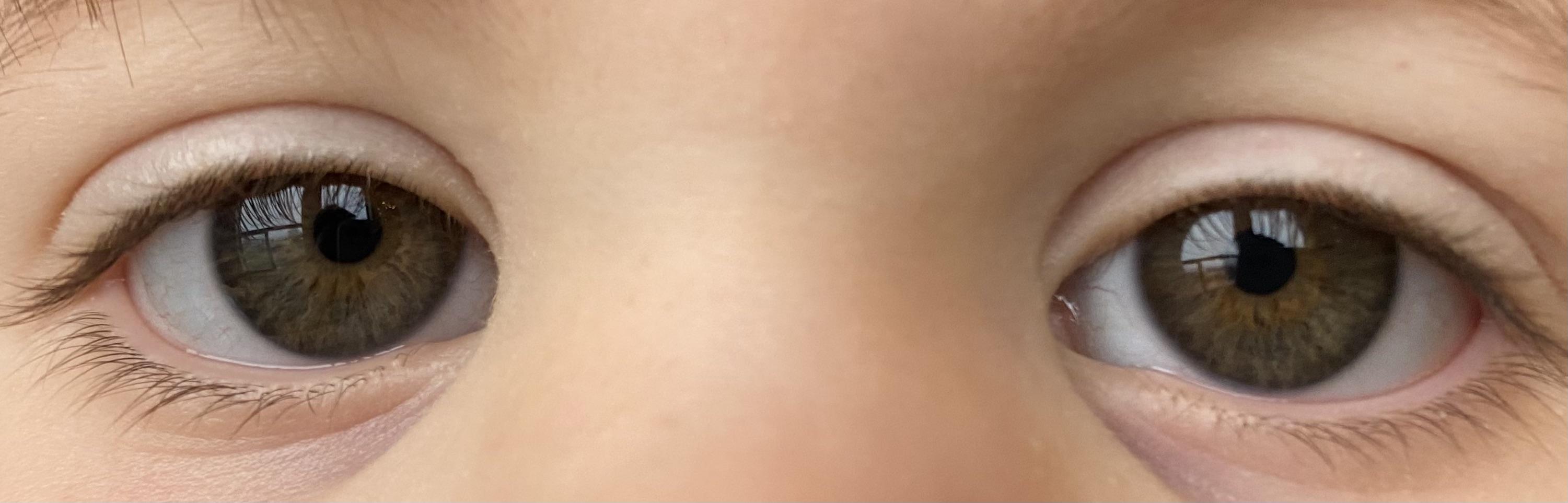 Is this hazel? | Scrolller