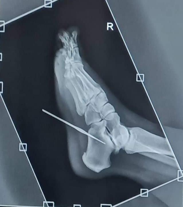 We showing x-rays now? Here's mine! | Scrolller
