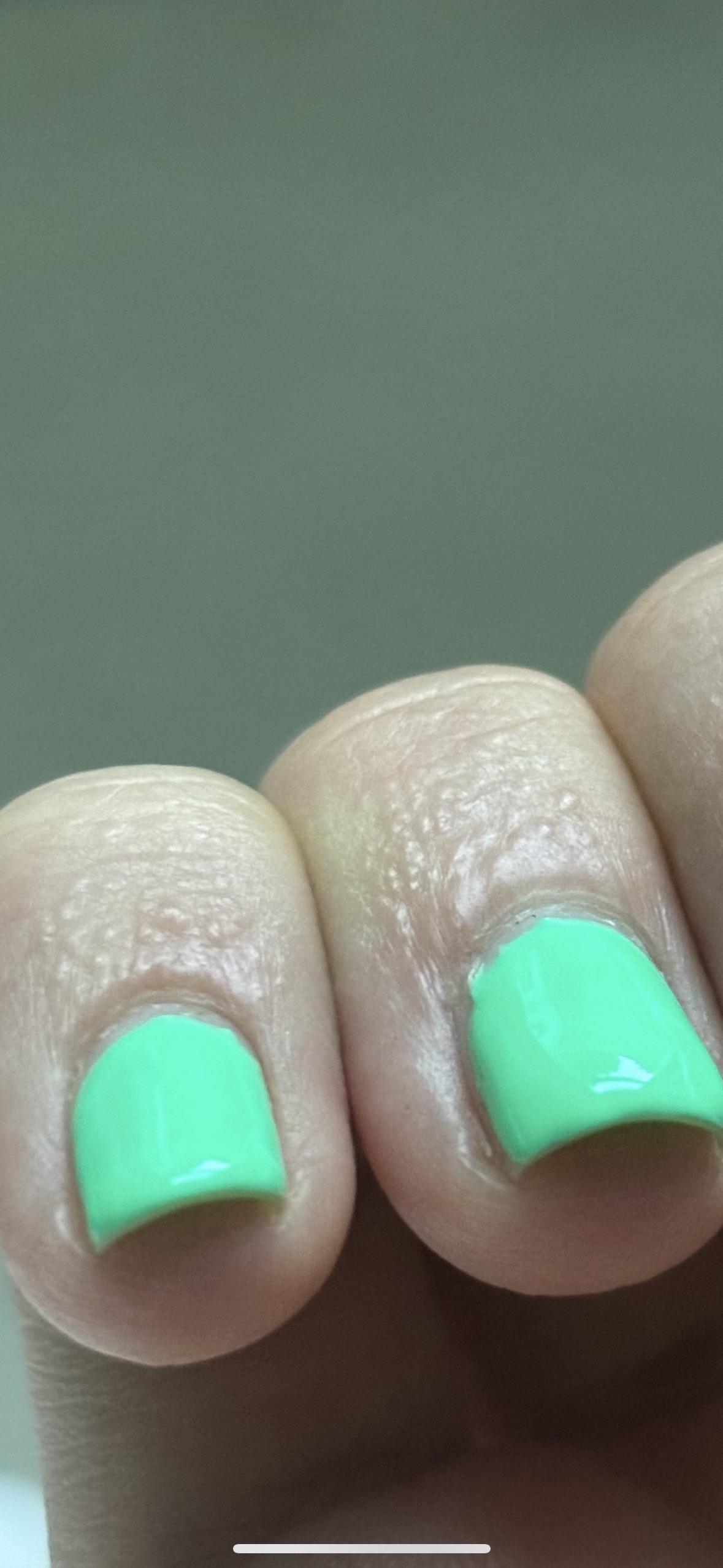 Normal?? | Scrolller