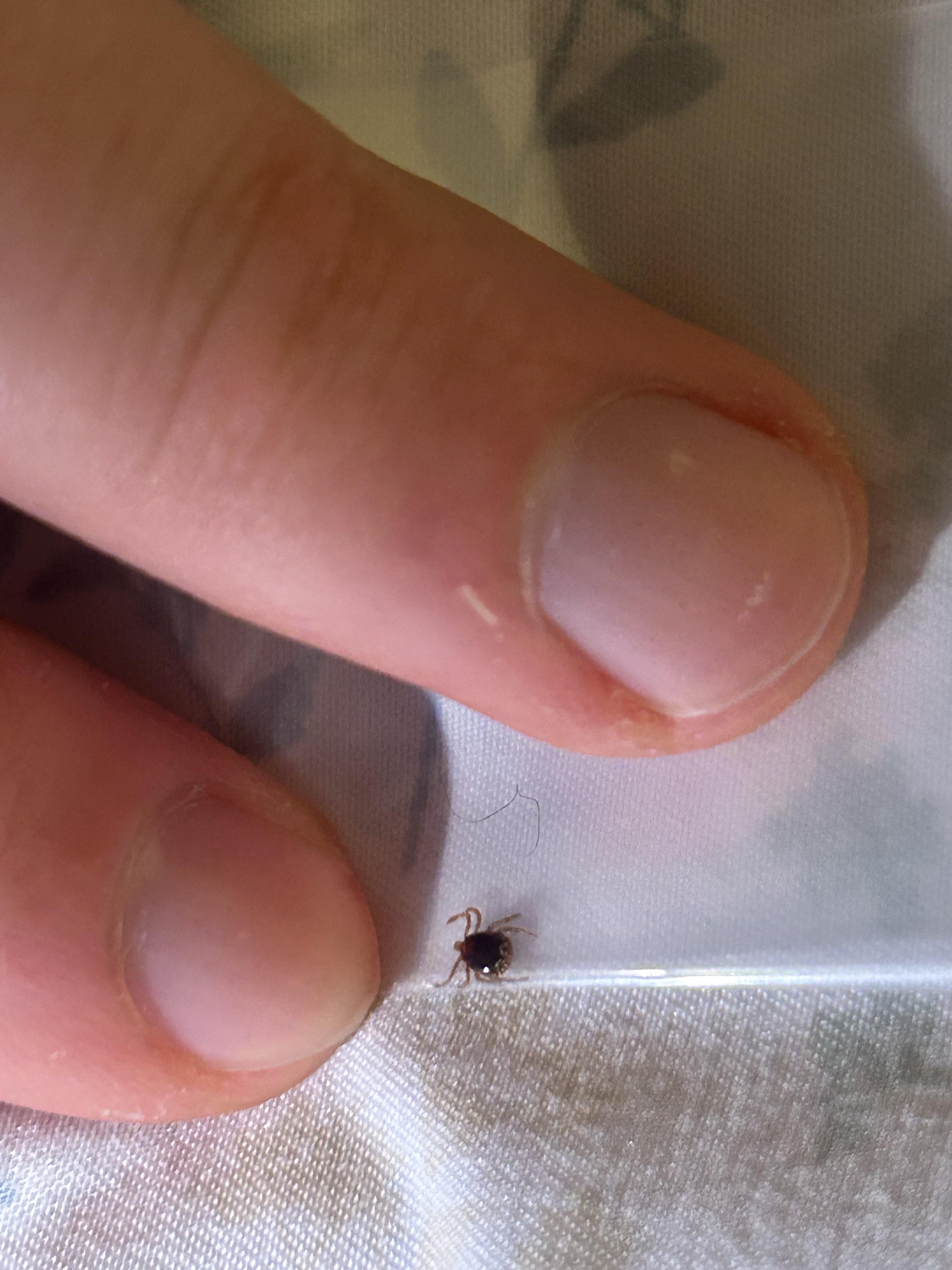 Can anyone identify this tick? | Scrolller