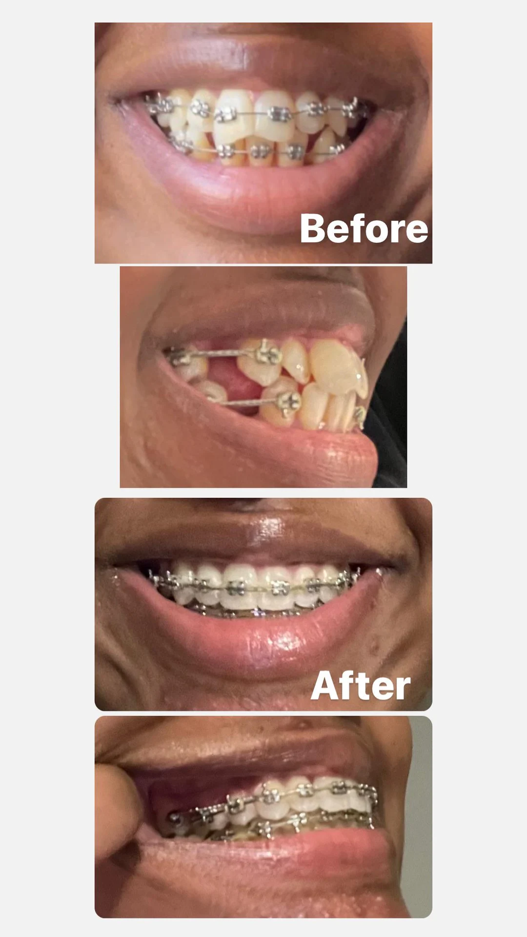 1 year and 8 months difference! | Scrolller