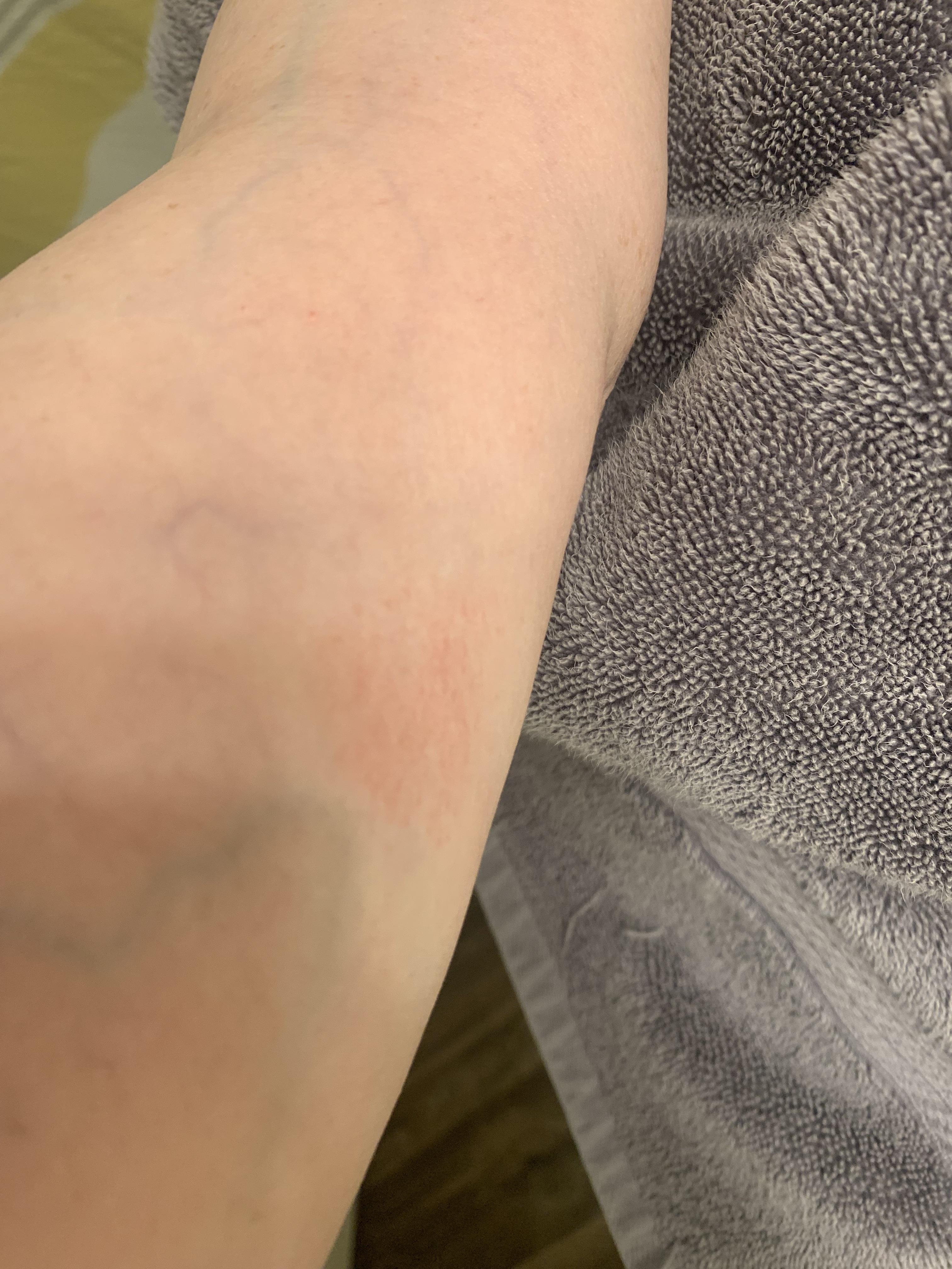 Dry skin patches ? | Scrolller