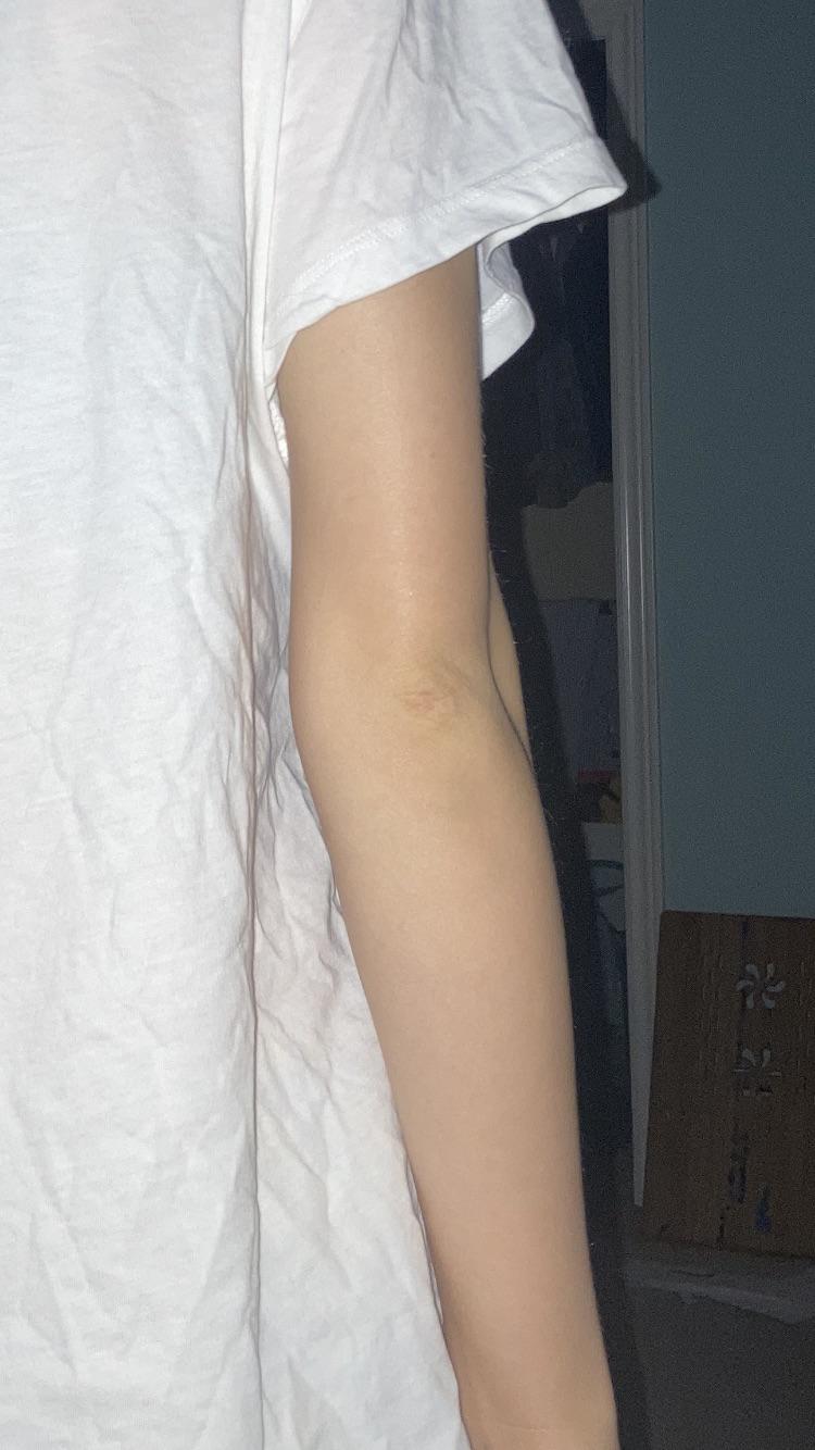 Would this tattoo placement work? or are my arms too small? | Scrolller