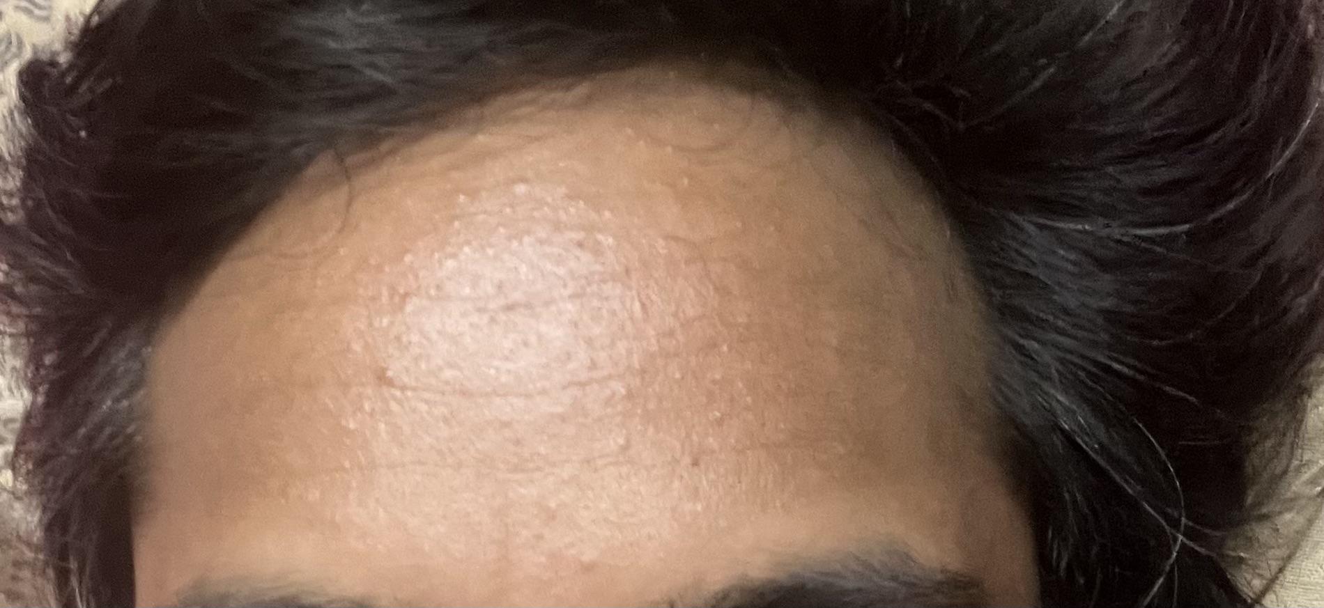 Please Help [bumps all over] | Scrolller