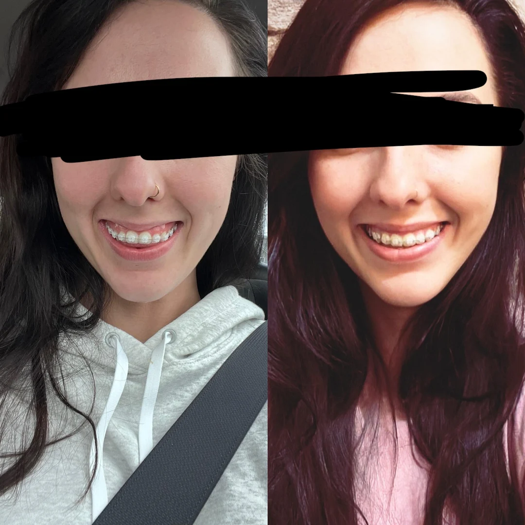 Smile comparison! | Scrolller