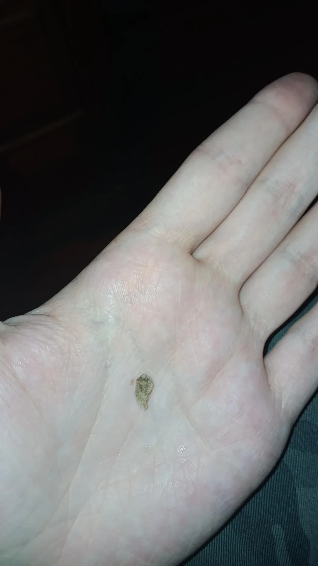 Is this mold | Scrolller