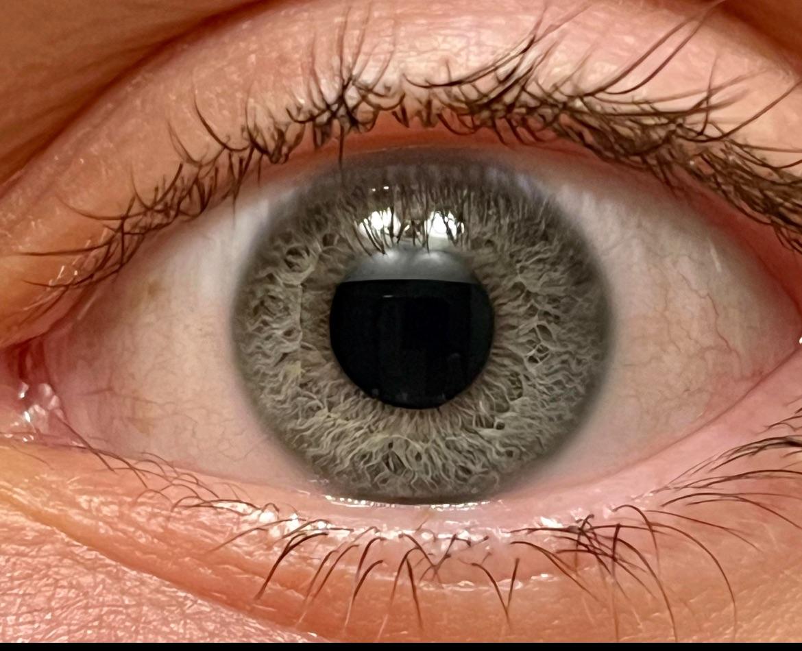 Close up of my eye | Scrolller