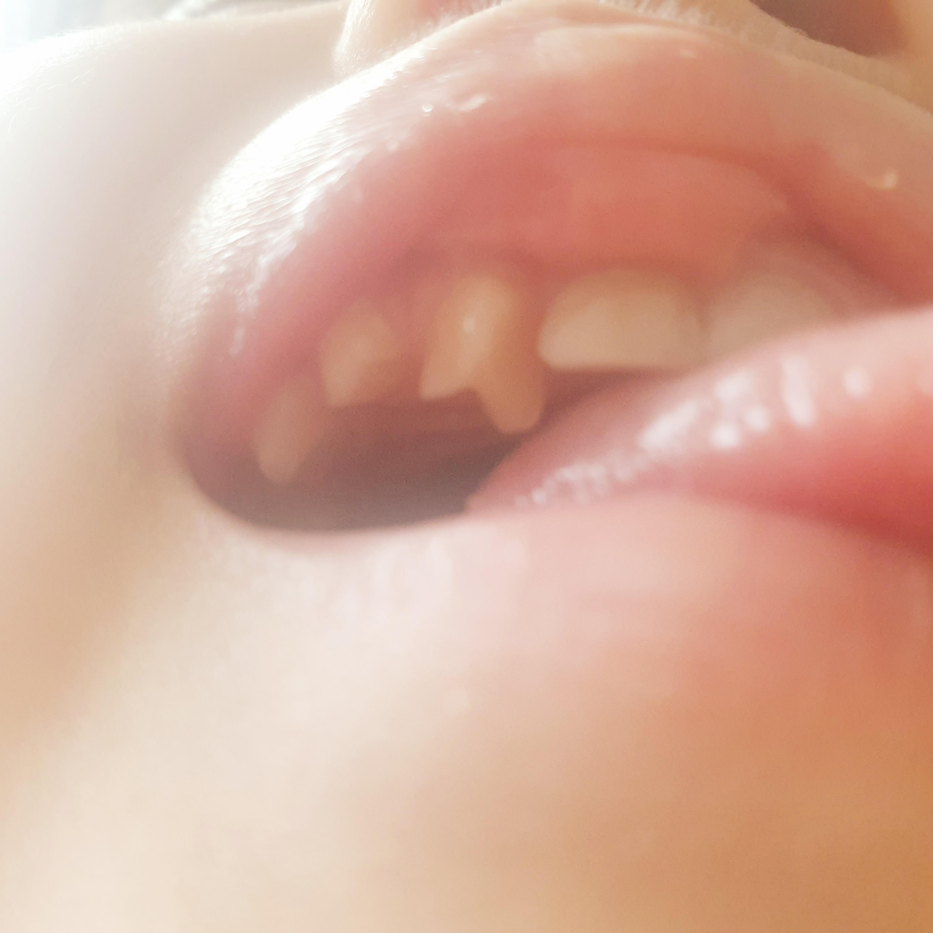 My brother's tooth | Scrolller