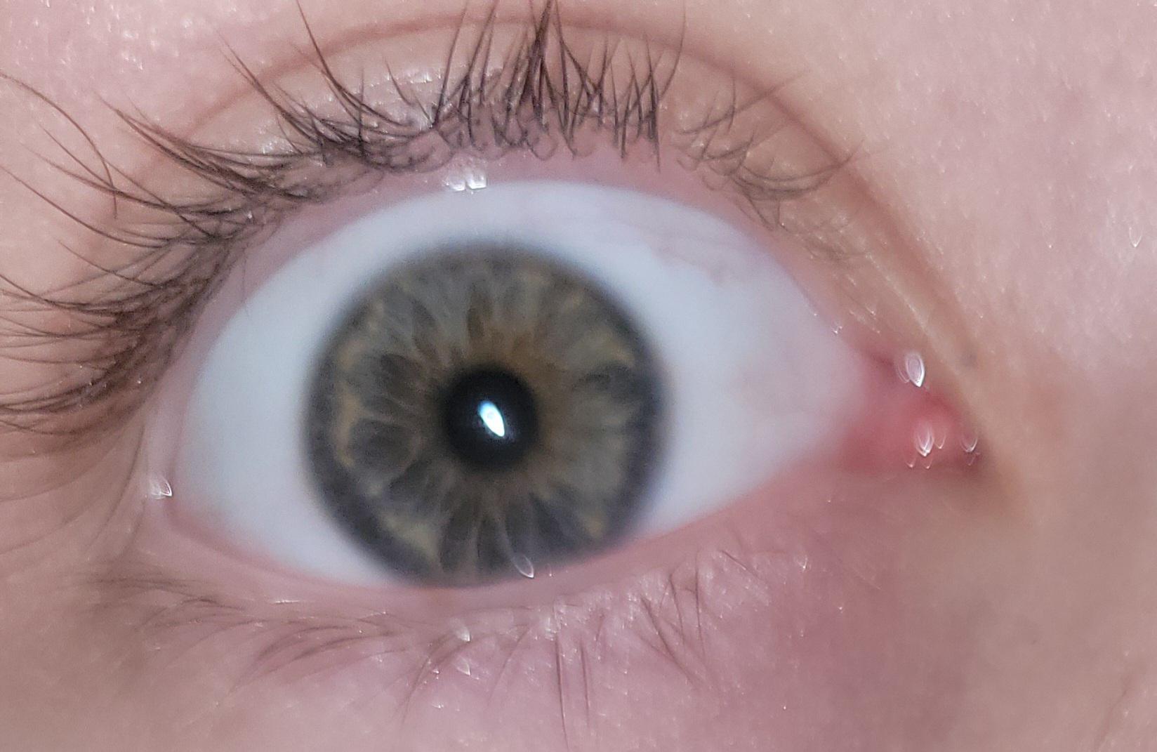 just wanted to share my grey/hazel eyes, i think they look cool. | Scrolller